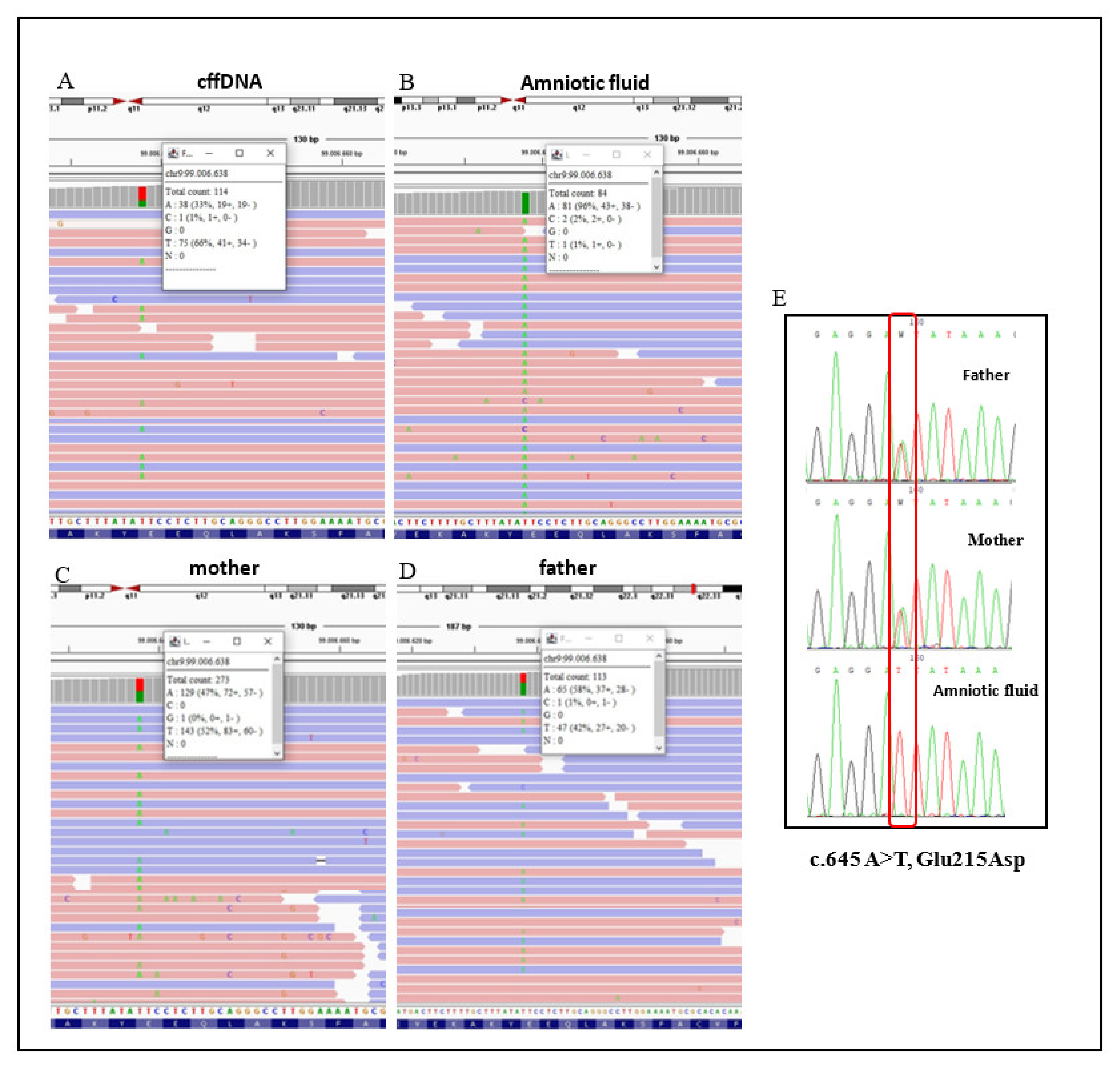 Detection Of 46 Xy Disorder Of Sex Development Dsd Based On Plasma