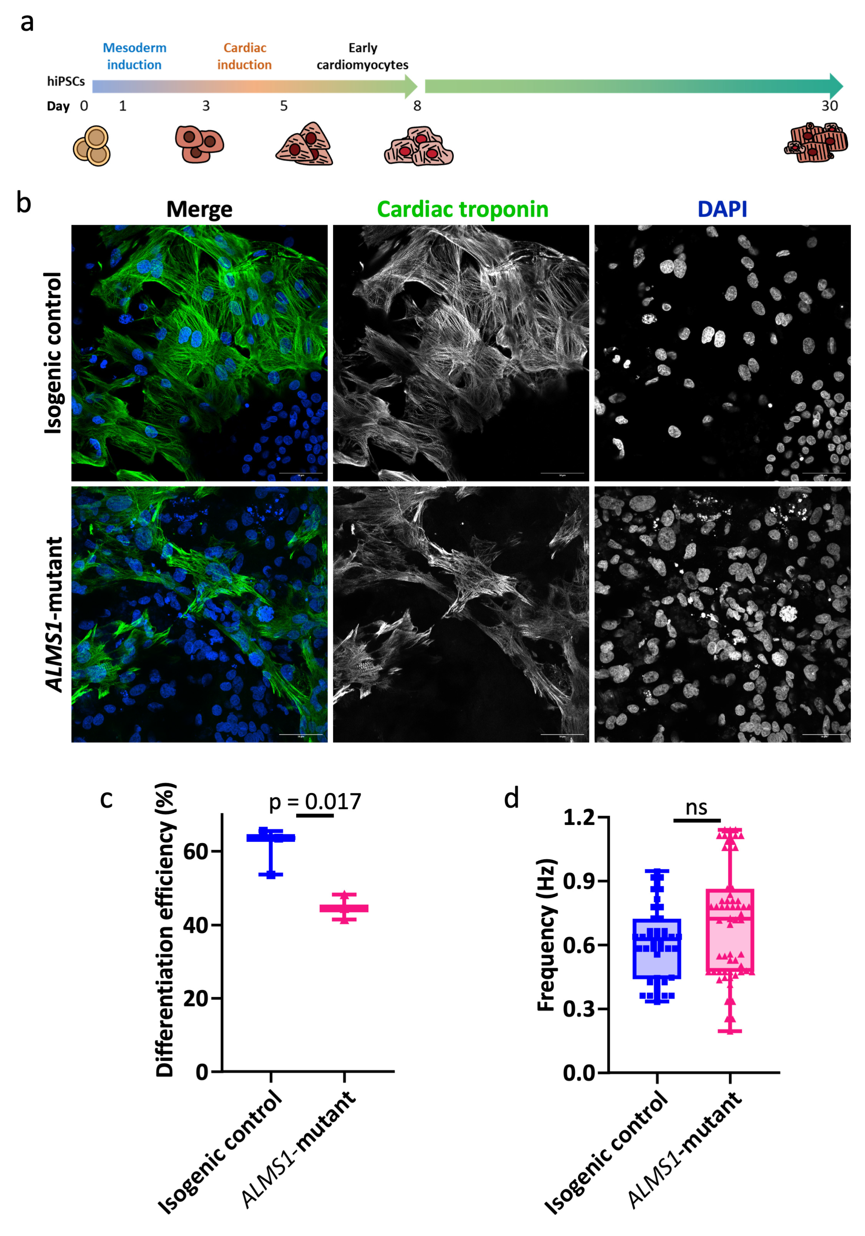 Characterisation of a Missense Variant of the Alström Syndrome ...