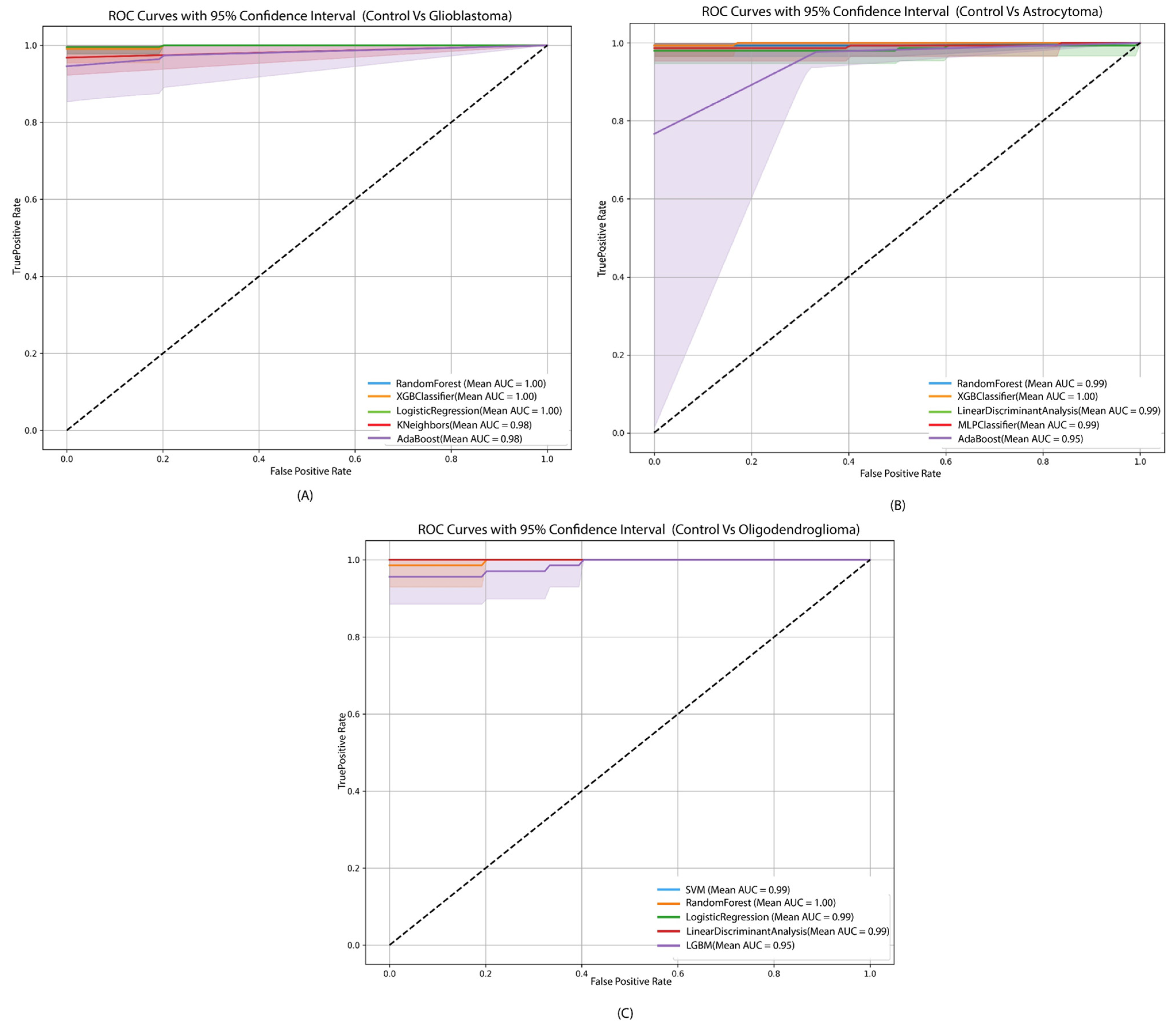 Machine Learning-Based Classification of Gliomas and Tumor Grades with ...