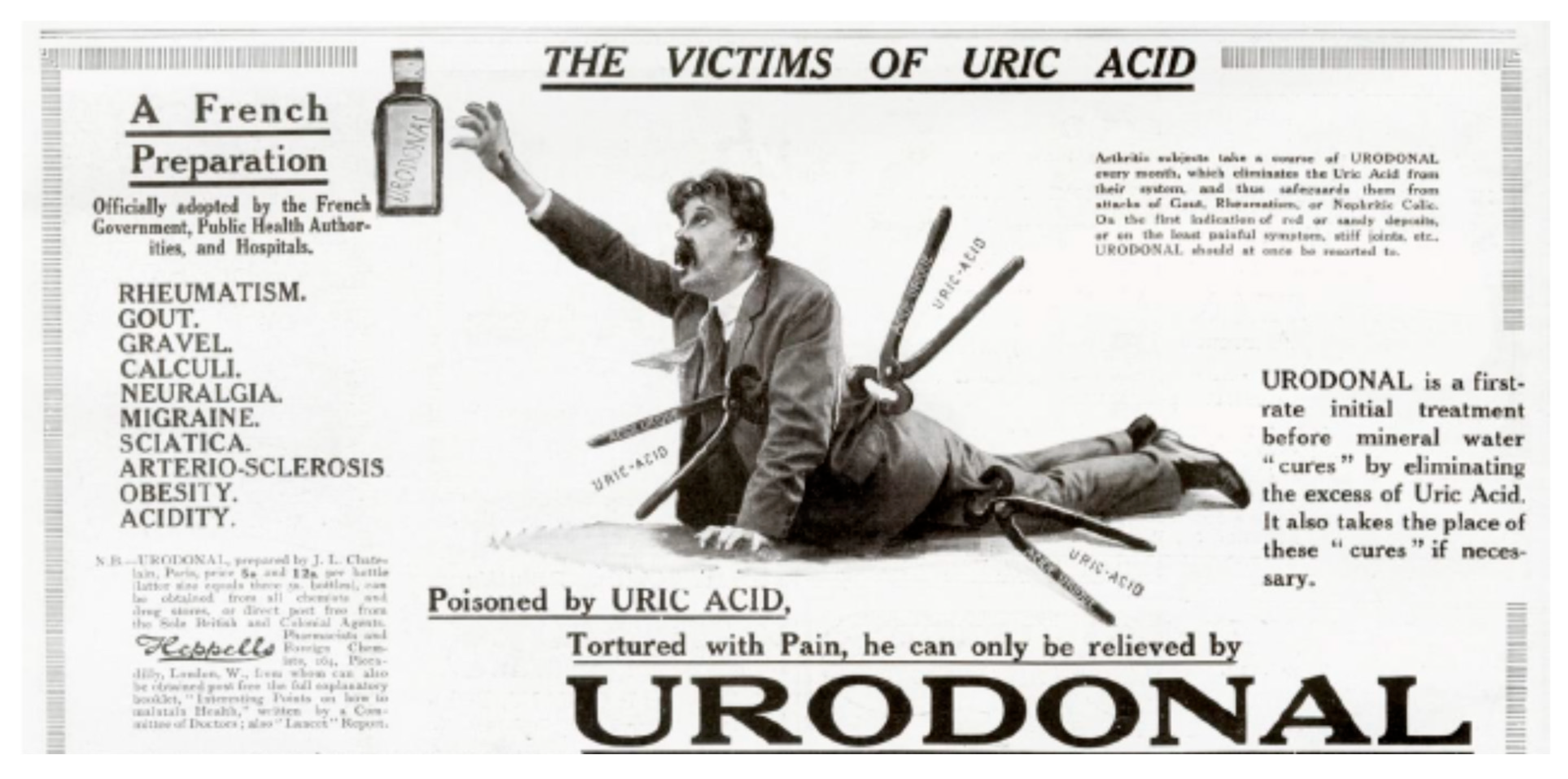 Irregular Gout, Asymptomatic Hyperuricaemia and the Role of Treatment