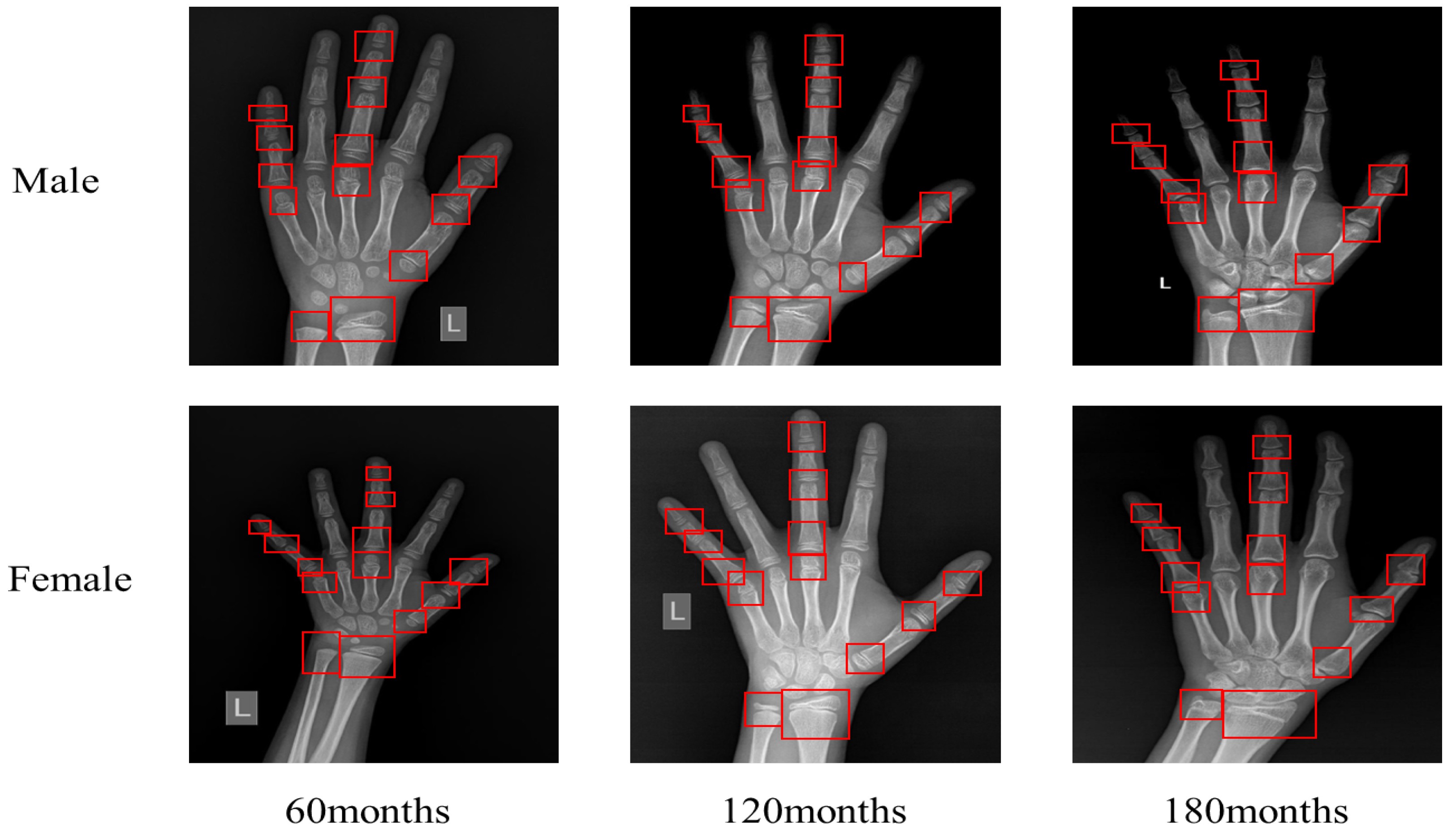 Healthcare Free Full Text Automated Bone Age Assessment A New Healthcare Free Full Text Automated Bone Age Assessment A New