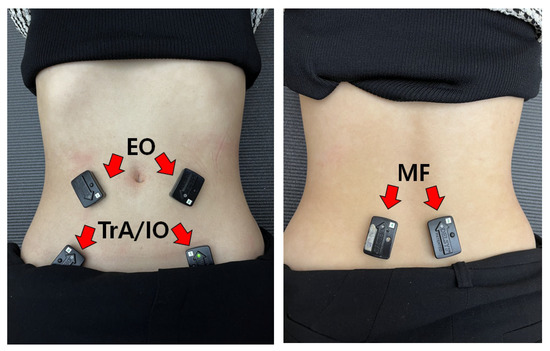 The Effects of Abdominal Hollowing and Bracing Maneuvers on Trunk ...