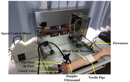A Clinical Trial of the Effect of a Blood Leakage Detection Device for ...