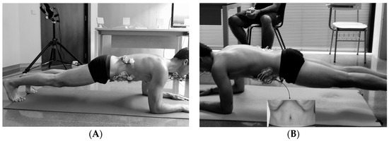 Influence of Abdominal Hollowing Maneuver on the Core Musculature ...