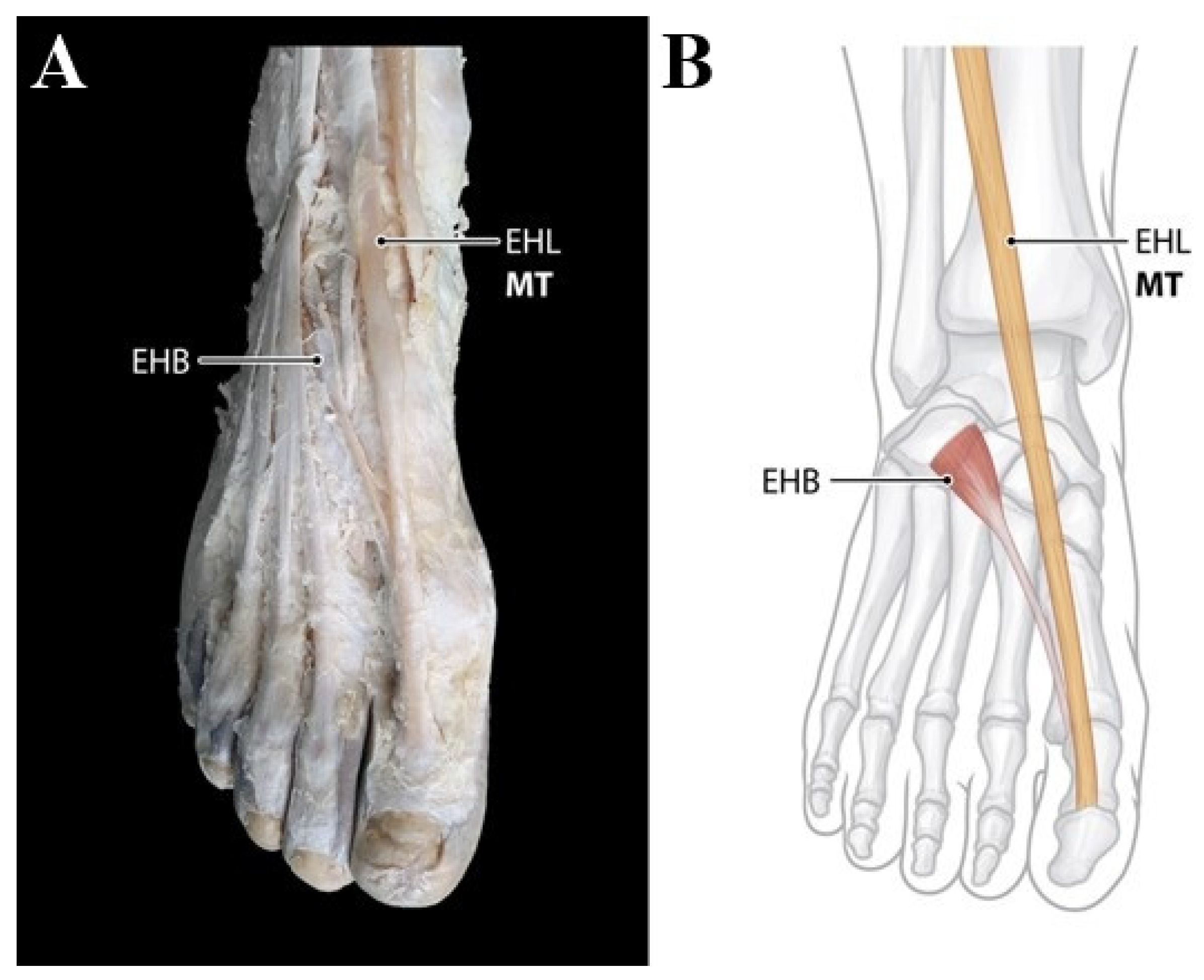 IJERPH Free Full Text Anatomical Characteristics Of Extensor IJERPH Free Full Text Anatomical Characteristics Of Extensor