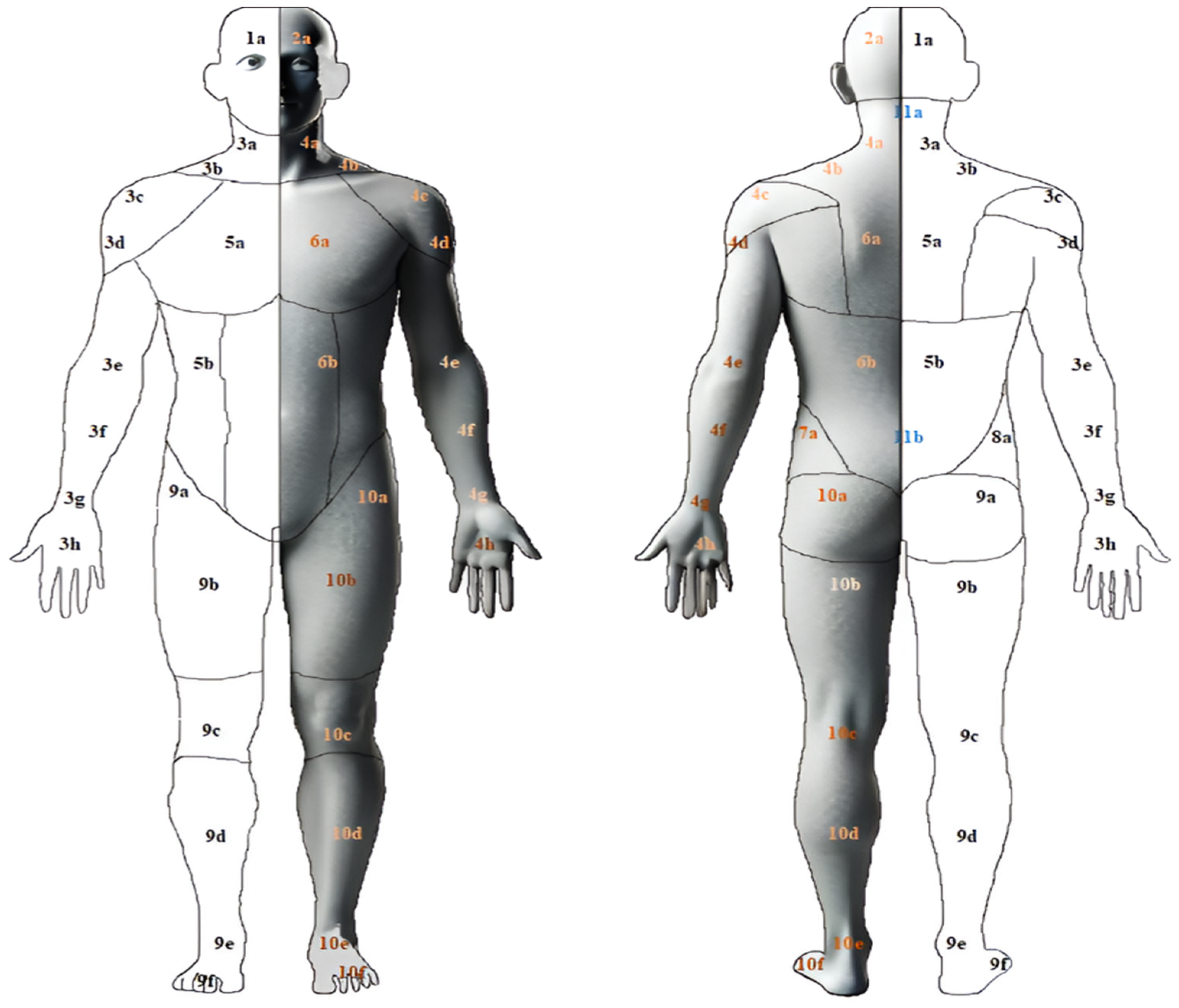 Bridging the Gap in Pain Measurement with a Brain-Based Index
