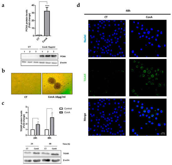 TP53-Induced Glycolysis and Apoptosis Regulator (TIGAR) Is Upregulated ...