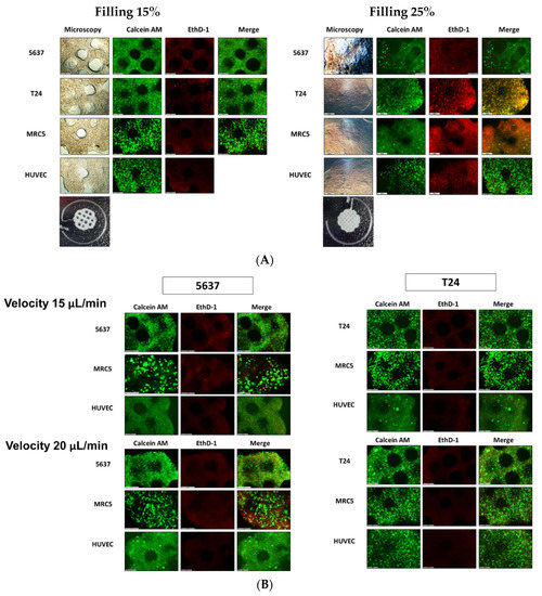 Establishment of Three-Dimensional Bioprinted Bladder Cancer-on-a-Chip ...