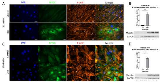 Ijms Free Full Text A20 Attenuates The Fibrotic Response In The
