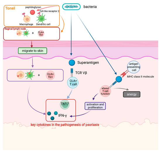 IJMS | Free Full-Text | Roles of Infection in Psoriasis