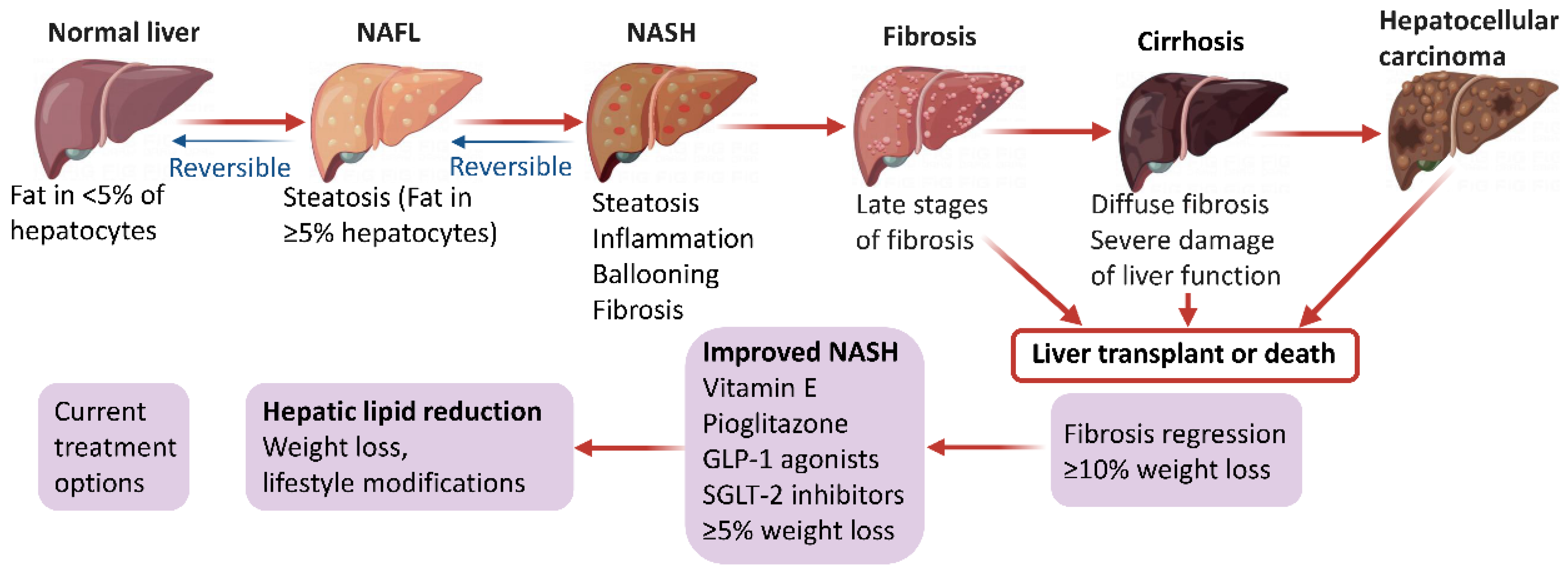 IJMS Free Full Text Advances In The Diagnosis And Treatment Of Non IJMS Free Full Text Advances In The Diagnosis And Treatment Of Non
