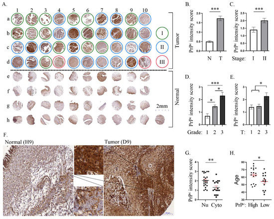 Melatonin-Assisted Cisplatin Suppresses Urinary Bladder Cancer Cell Proliferation and Growth ...