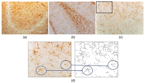 A Semi-Automatic Method for the Quantification of Astrocyte Number and ...