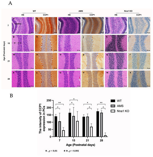 CCP1, a Regulator of Tubulin Post-Translational Modifications ...