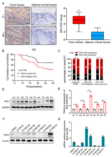 RIG-I Promotes Tumorigenesis and Confers Radioresistance of Esophageal ...