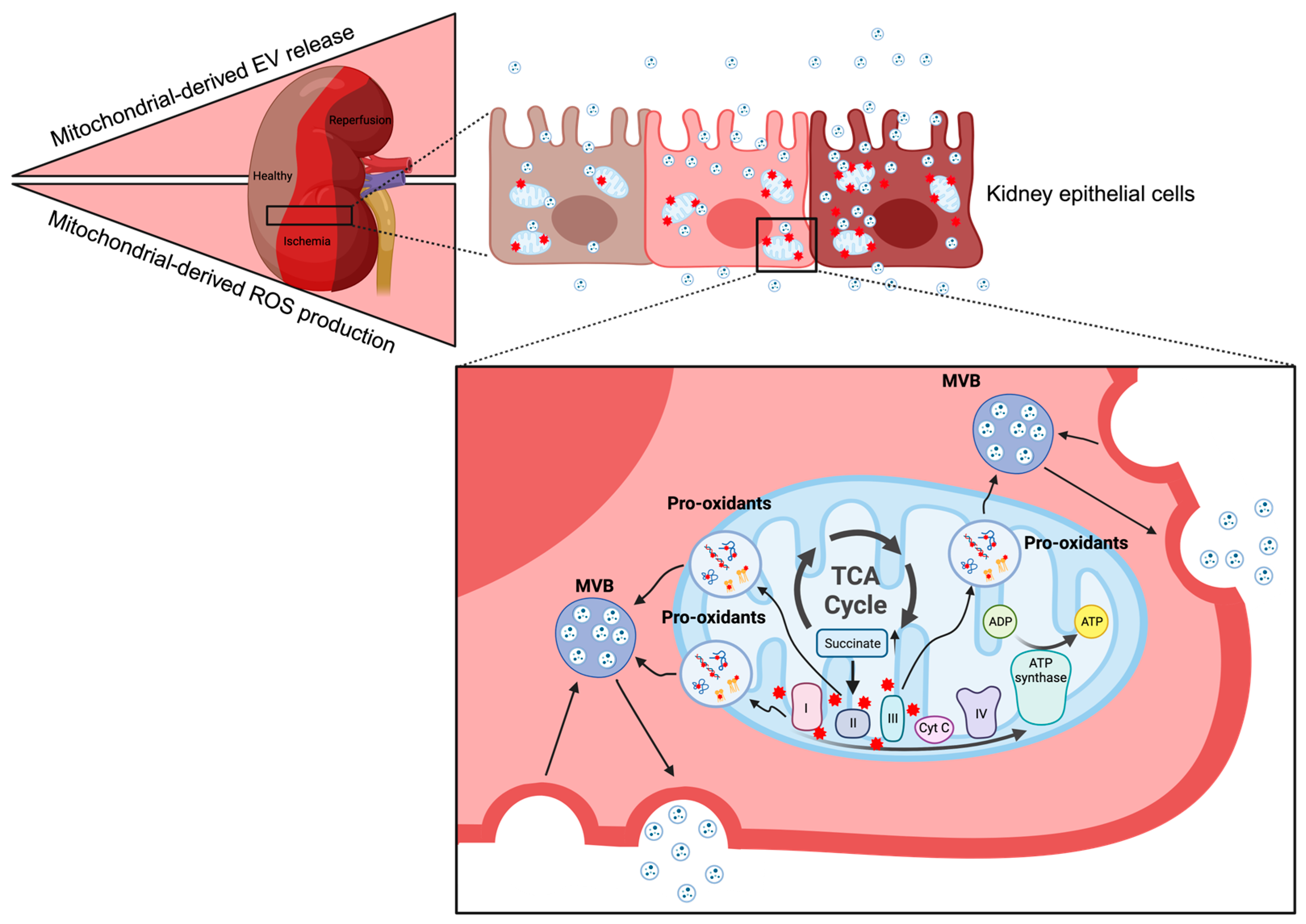 IJMS Free Full Text Acute Kidney Injury By Ischemia Reperfusion And IJMS Free Full Text Acute Kidney Injury By Ischemia Reperfusion And