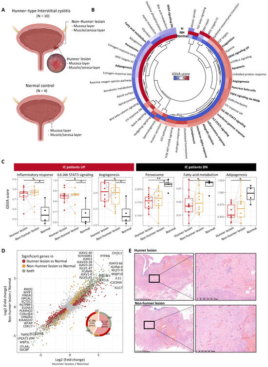 IJMS | Free Full-Text | Potential Role of Macrophage Polarization in the Progression of Hunner ...