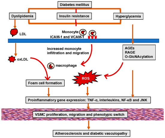 Diabetic Vasculopathy: Molecular Mechanisms and Clinical Insights