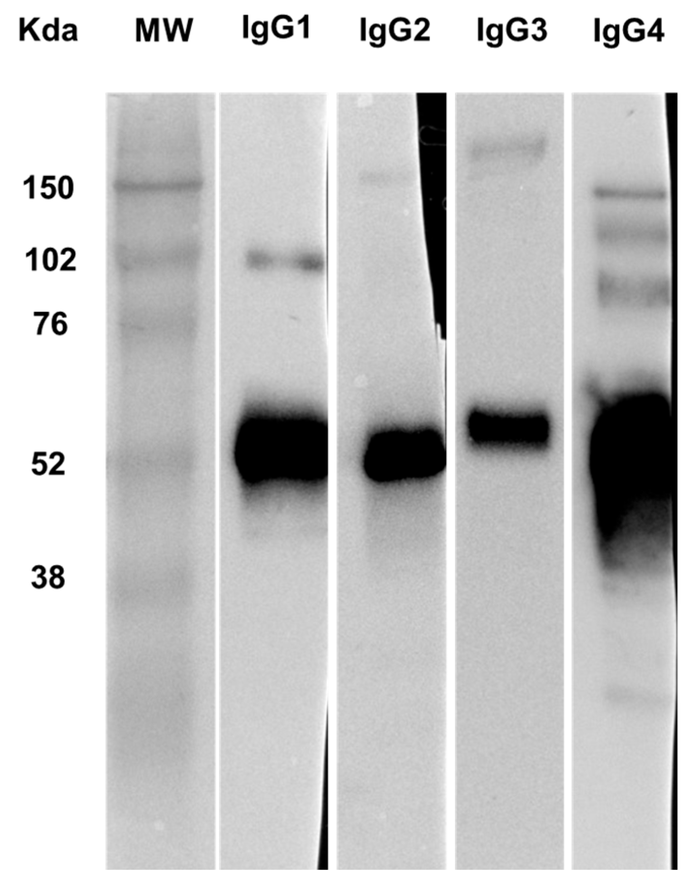 Possible Involvement of Circulating Immune Complex Containing IgG4 in ...