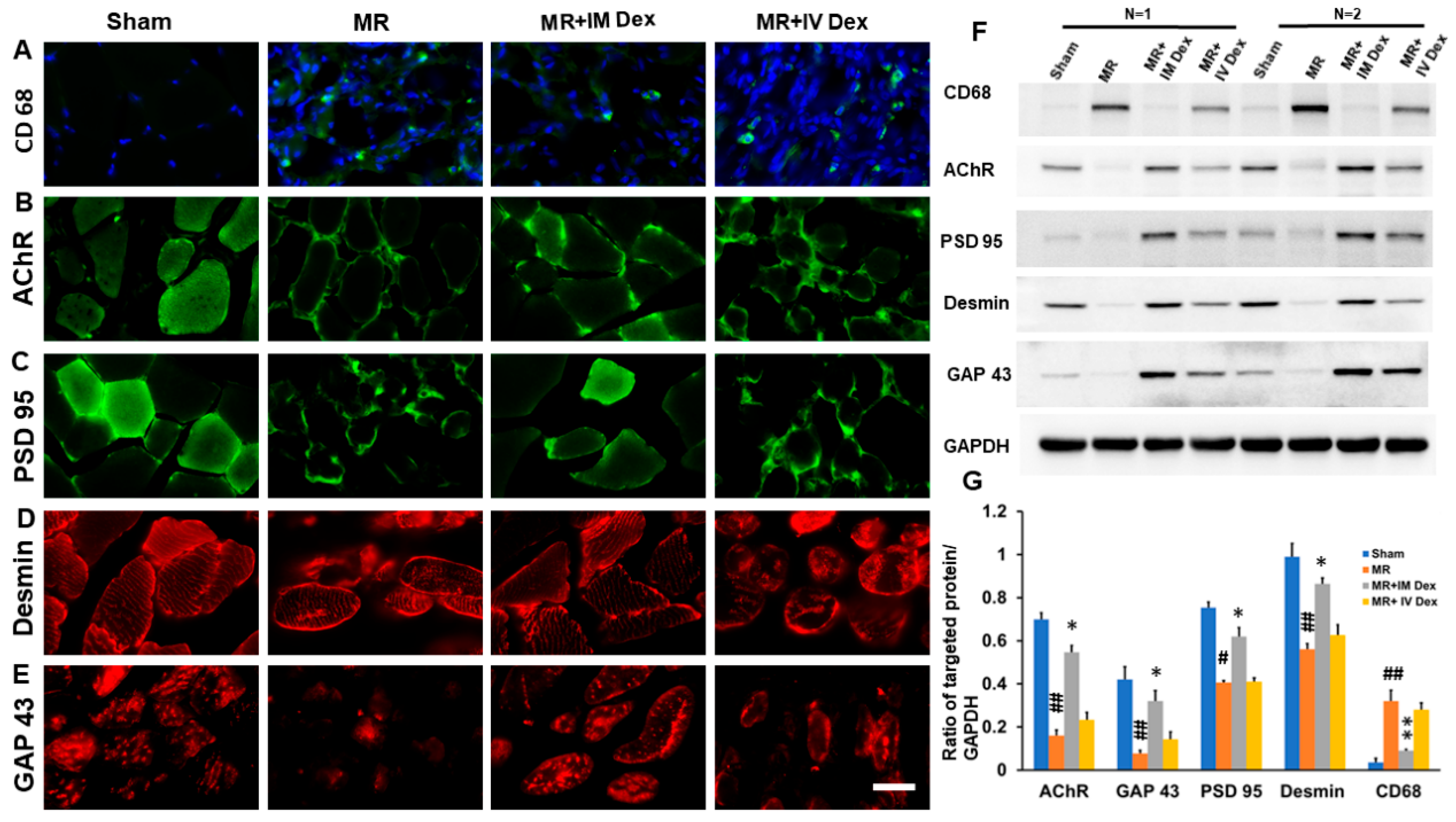 Benefits of Steroid Injections into Paraspinous Muscles After Spinal ...