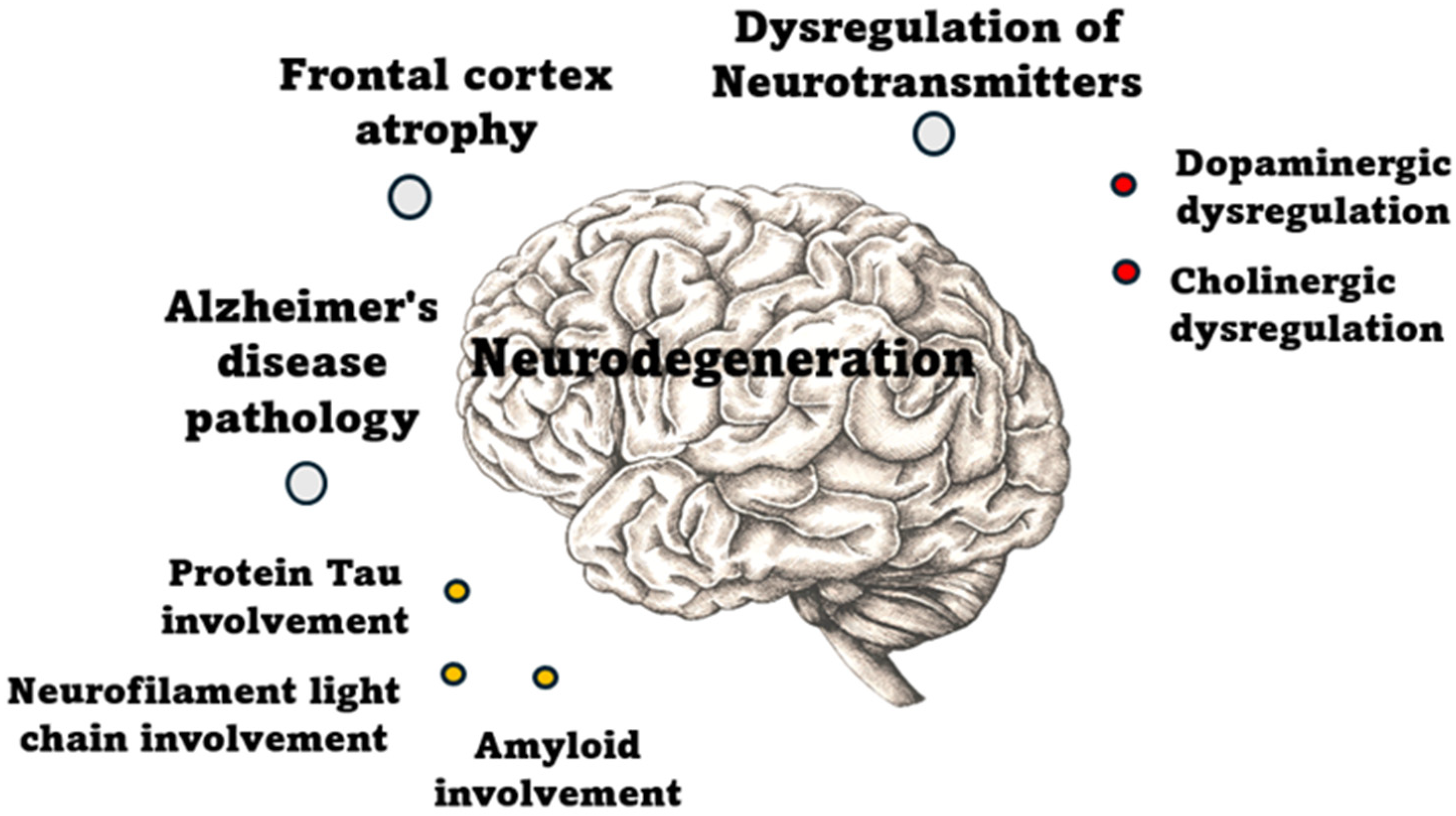 Post-Operative Delirium in Elderly Patients: A Narrative Review