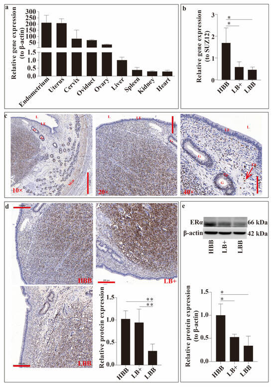ESR1 Regulates Fecundity and Functions in Sheep Endometrial Stromal Cells