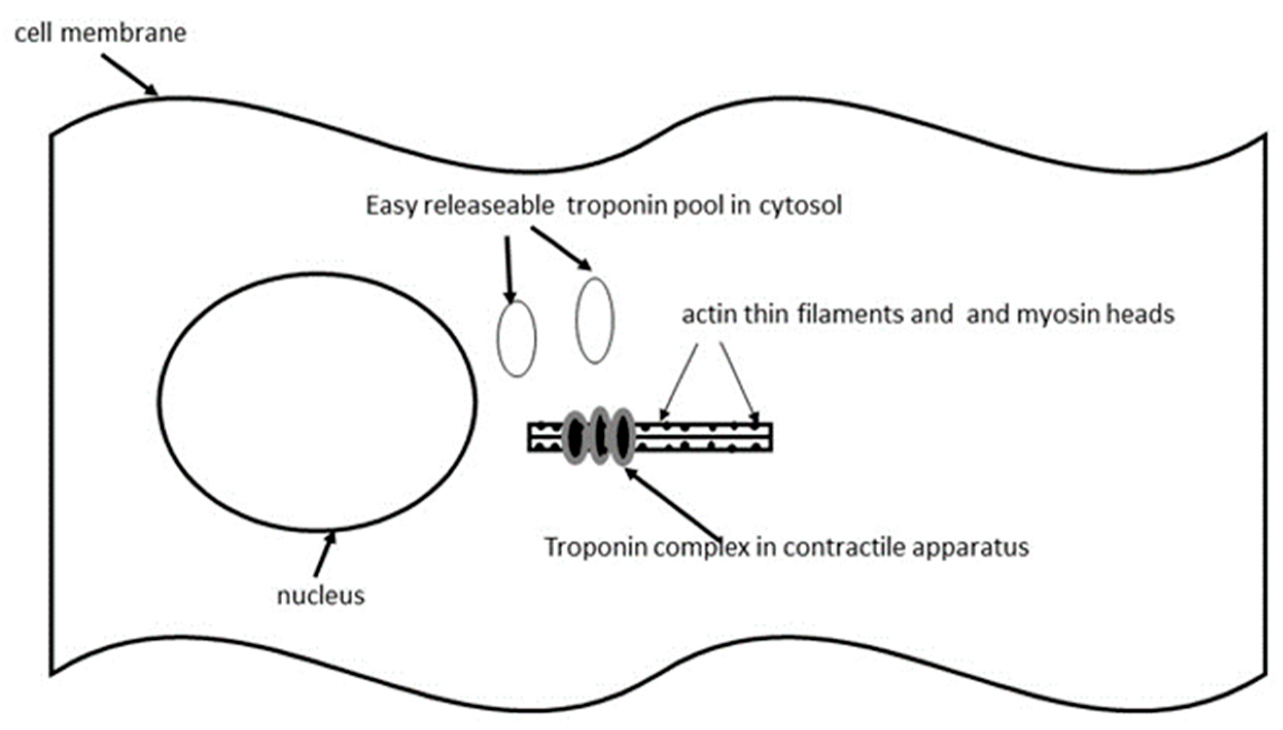 Elevated Cardiac Troponin in Non-Cardiac Conditions Unrelated to Acute ...
