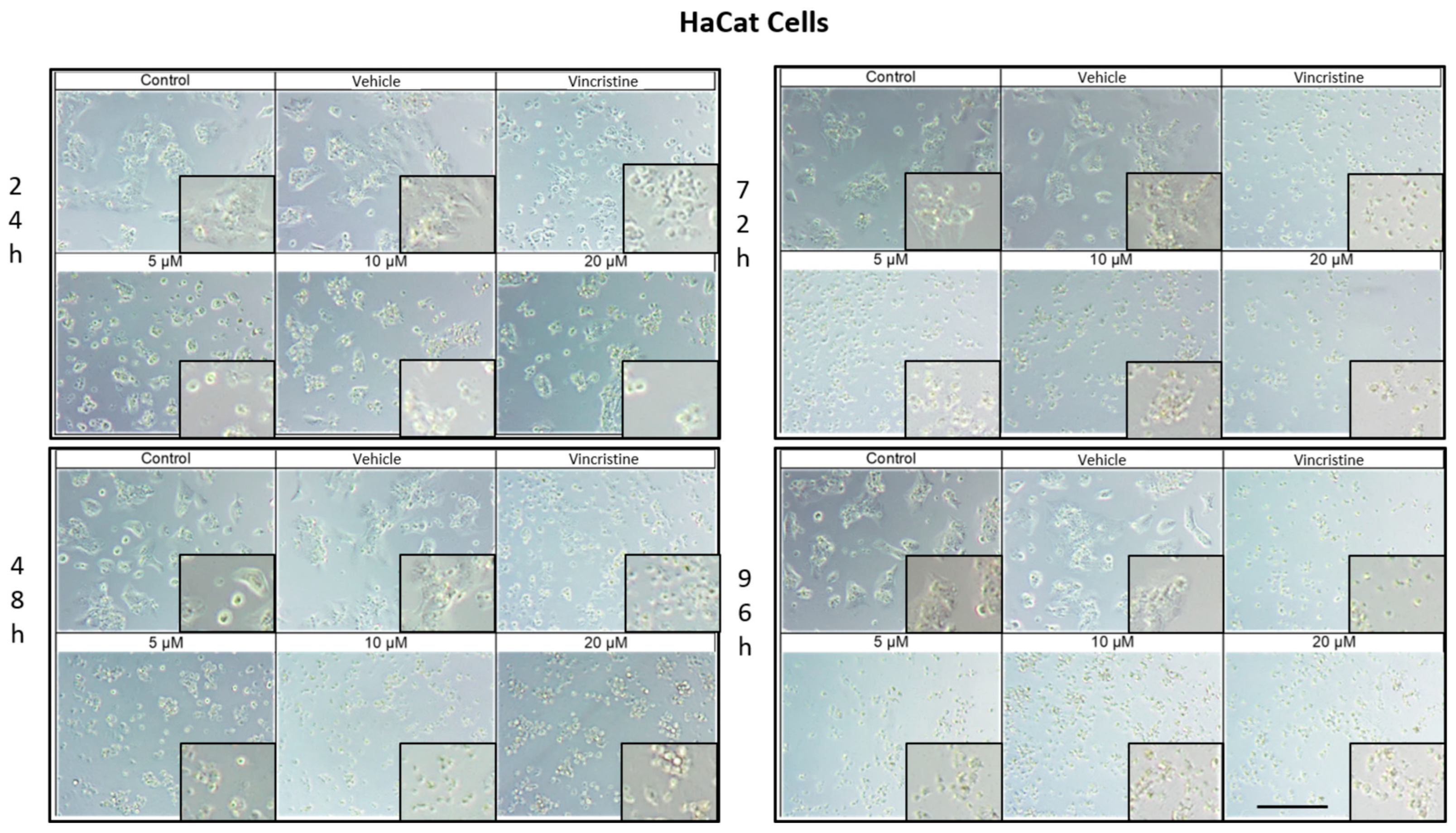 Targeting Human Cancer Cells with Cannabidiol (CBD): Apoptotic ...