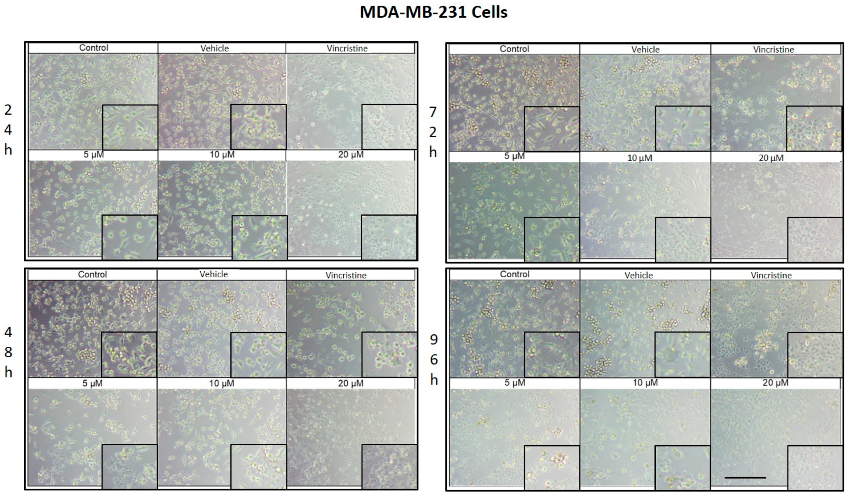 Targeting Human Cancer Cells with Cannabidiol (CBD): Apoptotic ...
