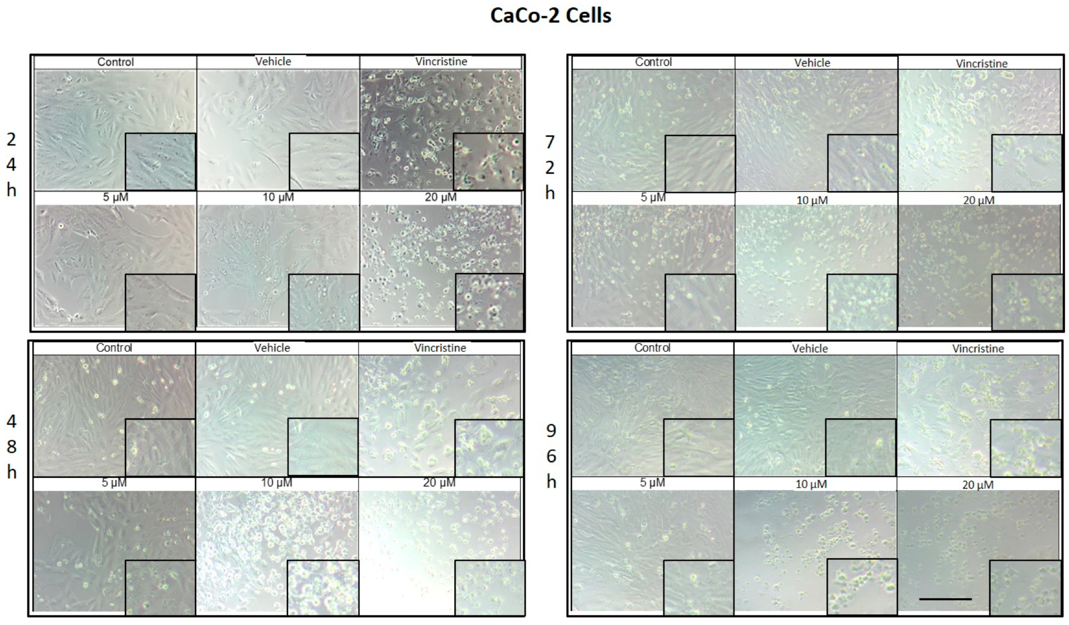 Targeting Human Cancer Cells with Cannabidiol (CBD): Apoptotic ...