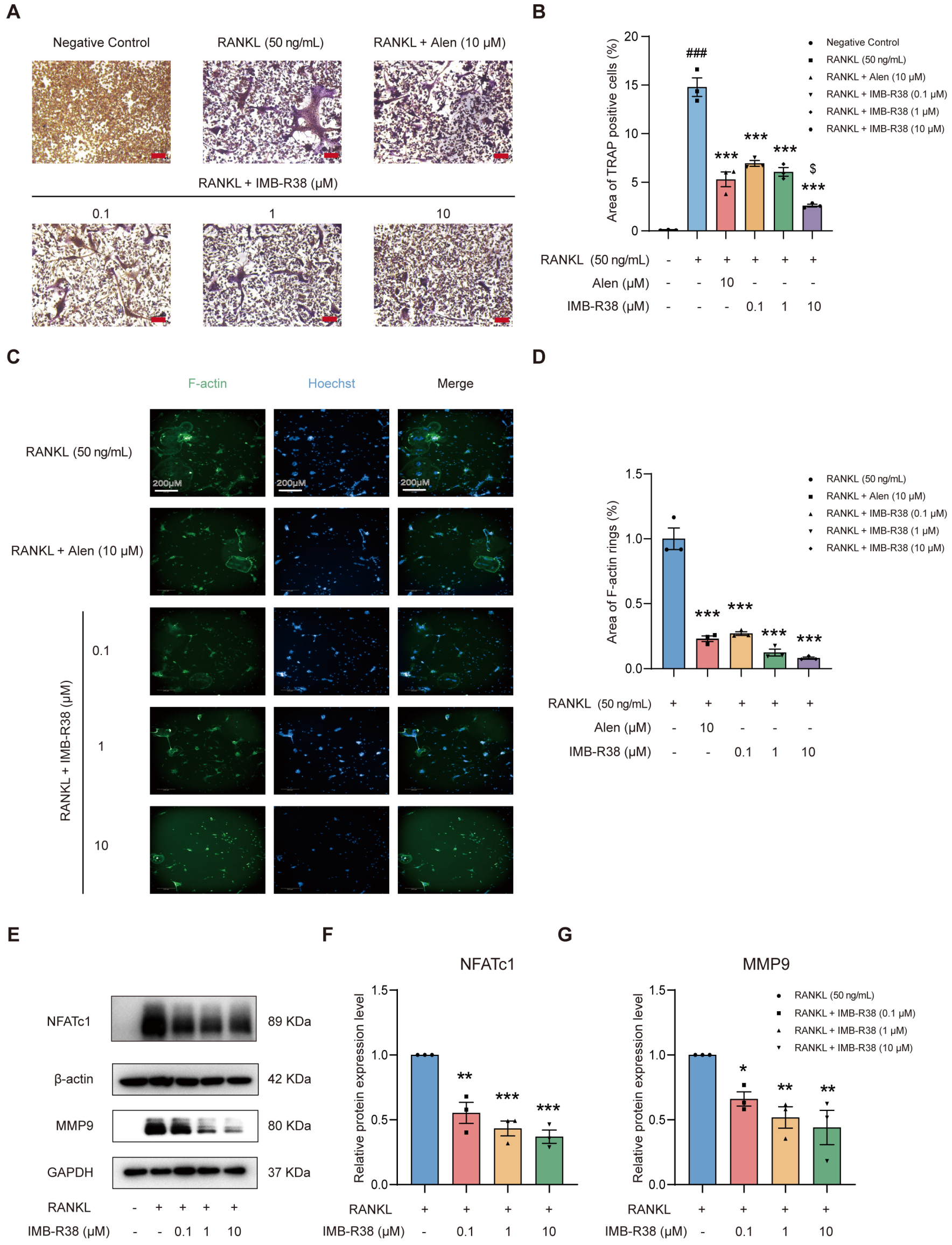 A Novel RANKL/RANK Inhibitor IMB-R38 Inhibits Osteoporosis Through ...