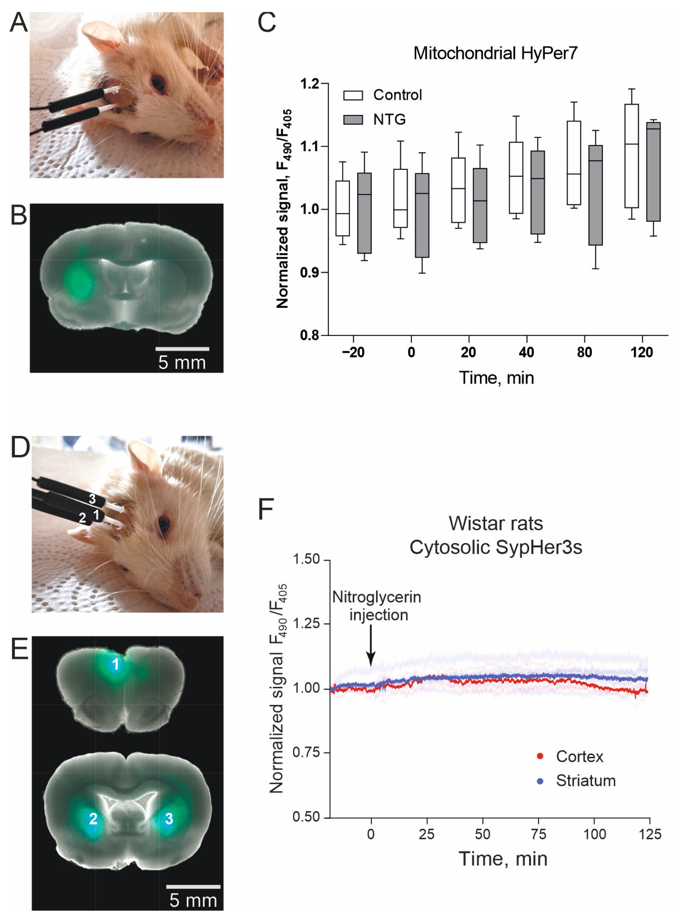 Neuroinflammatory and Redox Responses in a Rat Model of NTG-Induced ...