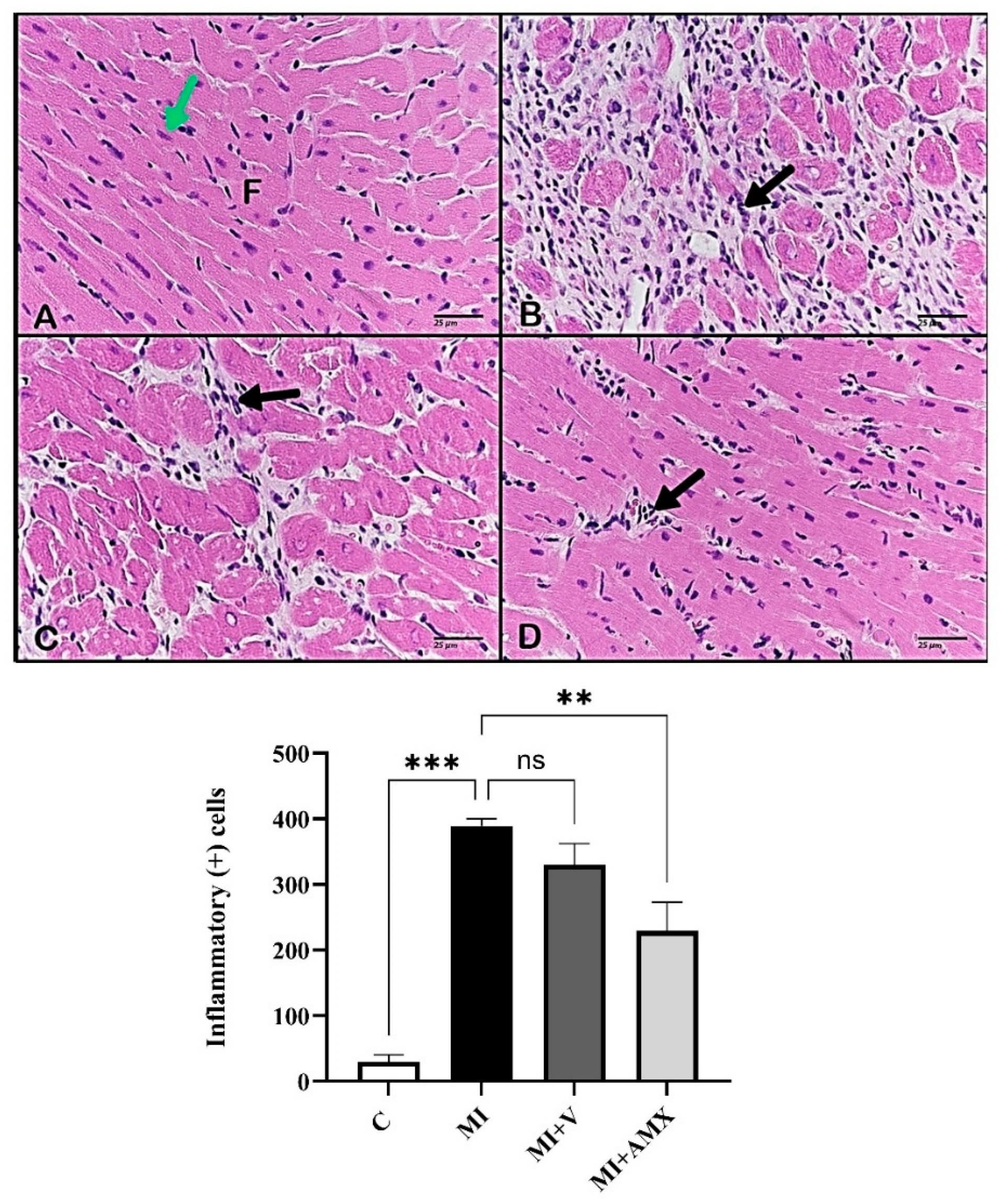 Potential Cardioprotective Effect of a GRK5 Inhibitor Against NF-κB ...