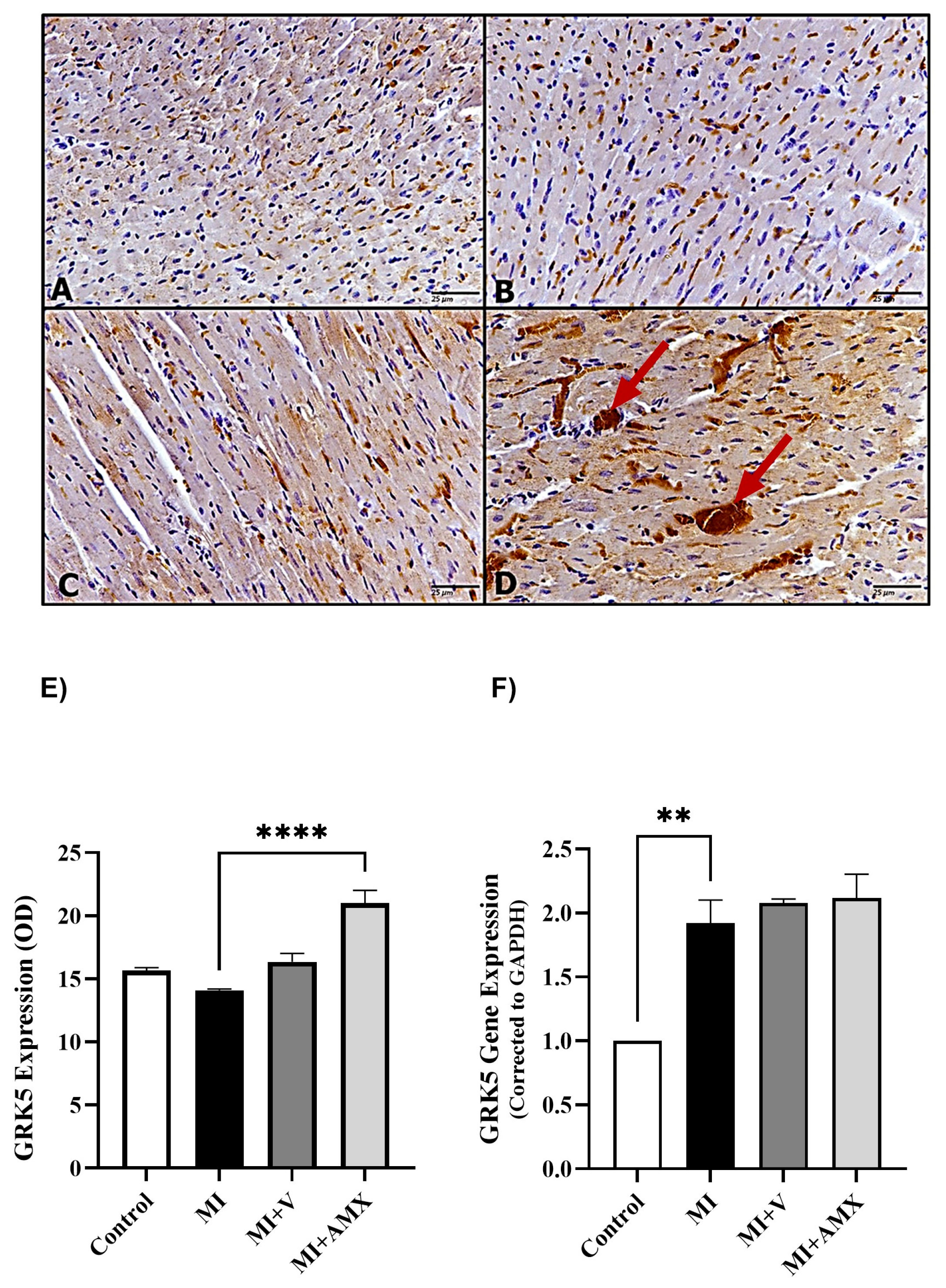 Potential Cardioprotective Effect of a GRK5 Inhibitor Against NF-κB ...
