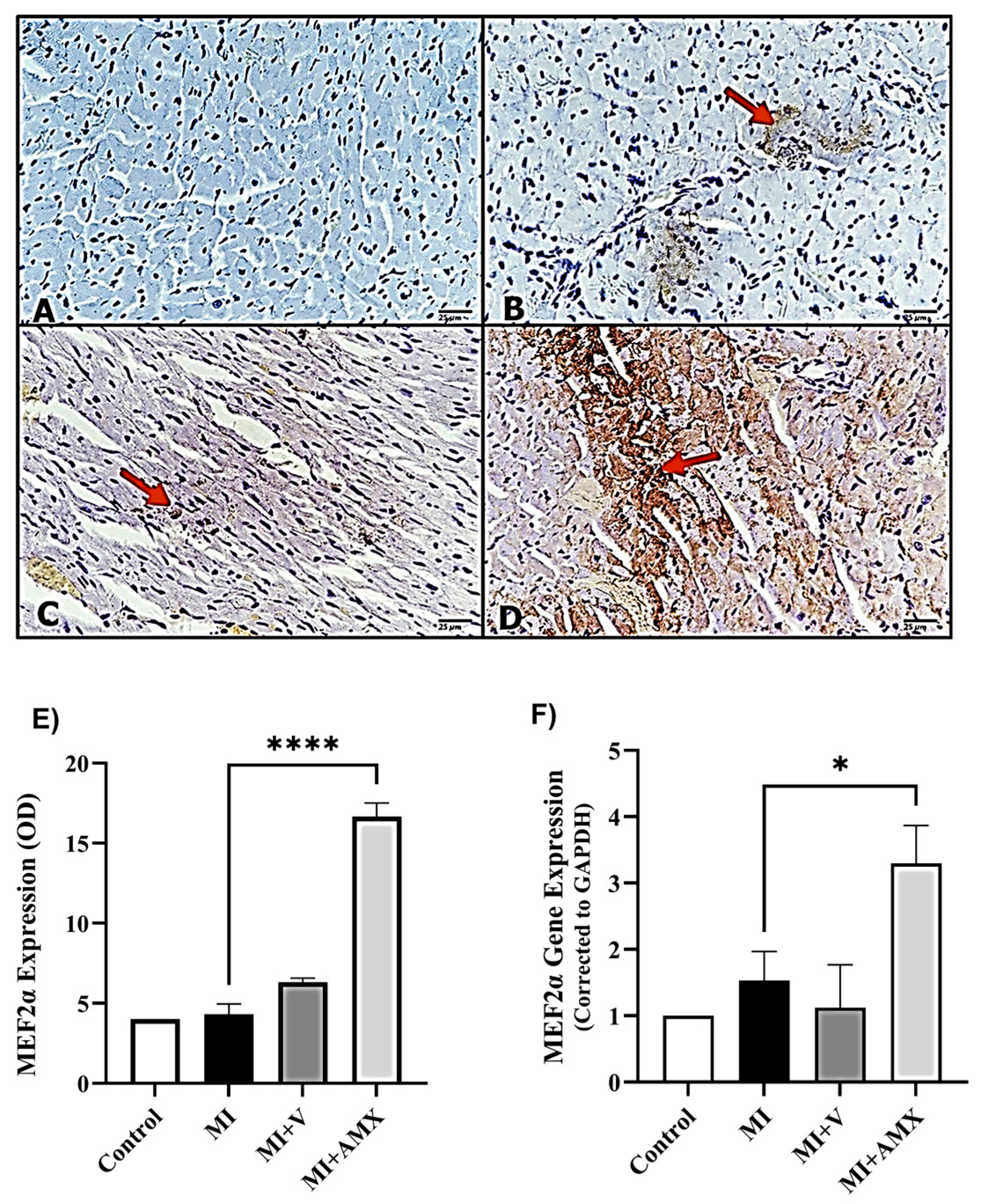 Potential Cardioprotective Effect of a GRK5 Inhibitor Against NF-κB ...