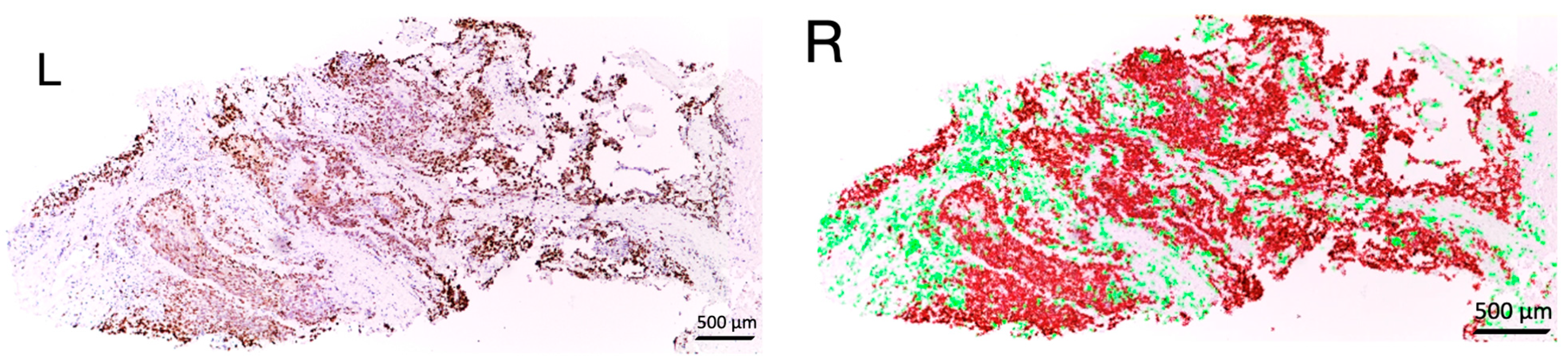 Conceptualization of an Ex Vivo Organ Culture (EVOC) Model for Human ...