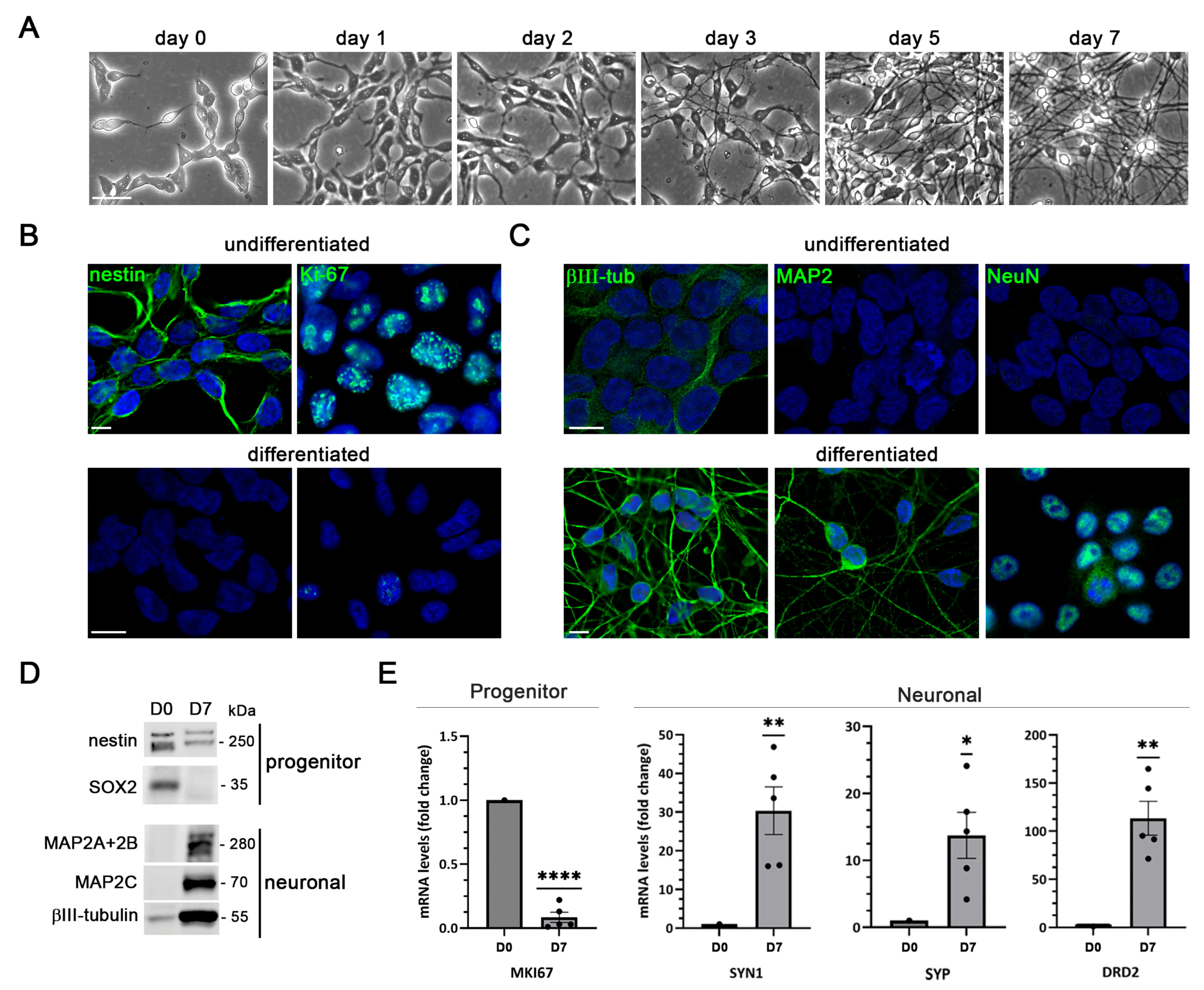Impact of HSV-1 Infection on Alzheimer’s Disease Neurodegeneration ...