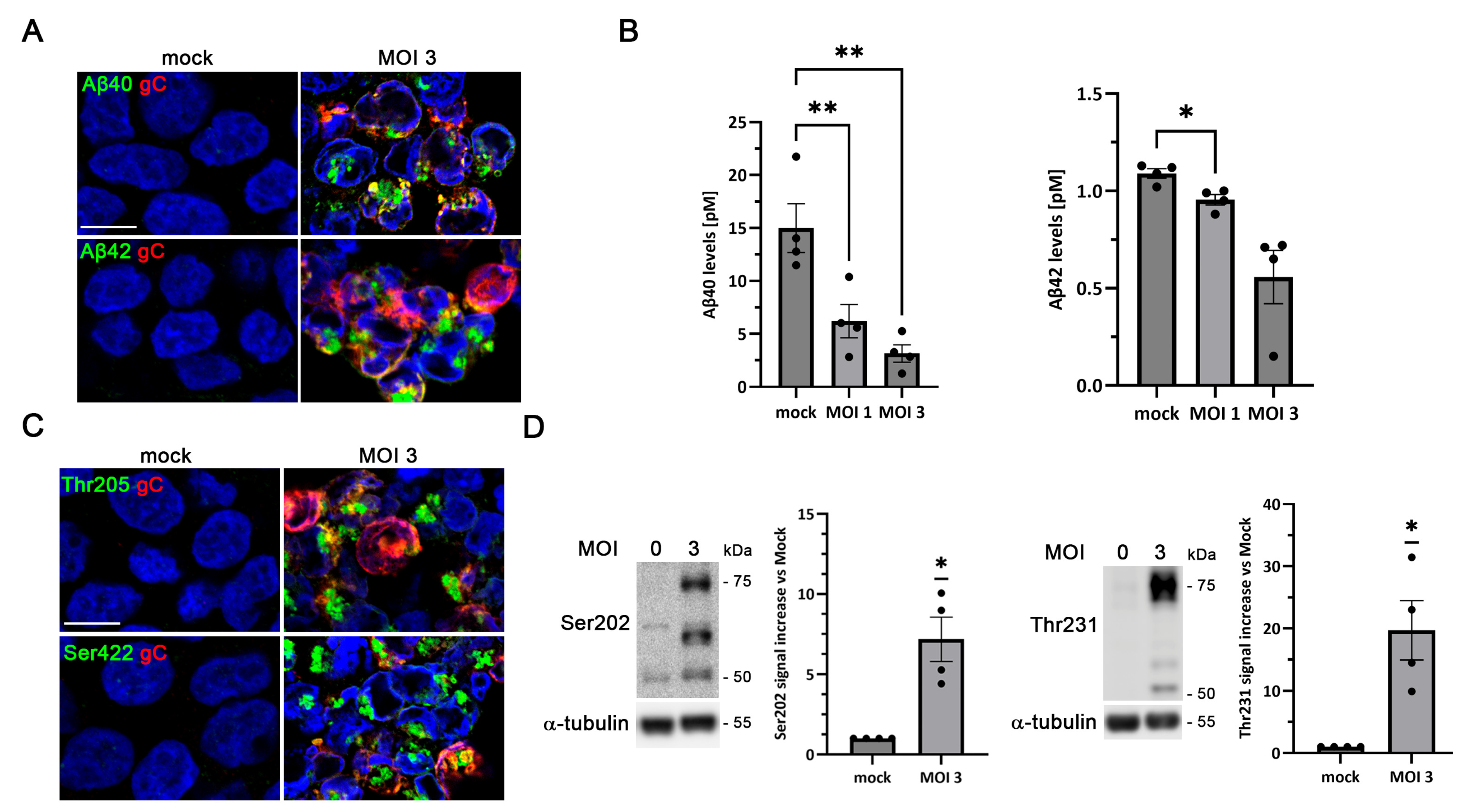 Impact of HSV-1 Infection on Alzheimer’s Disease Neurodegeneration ...