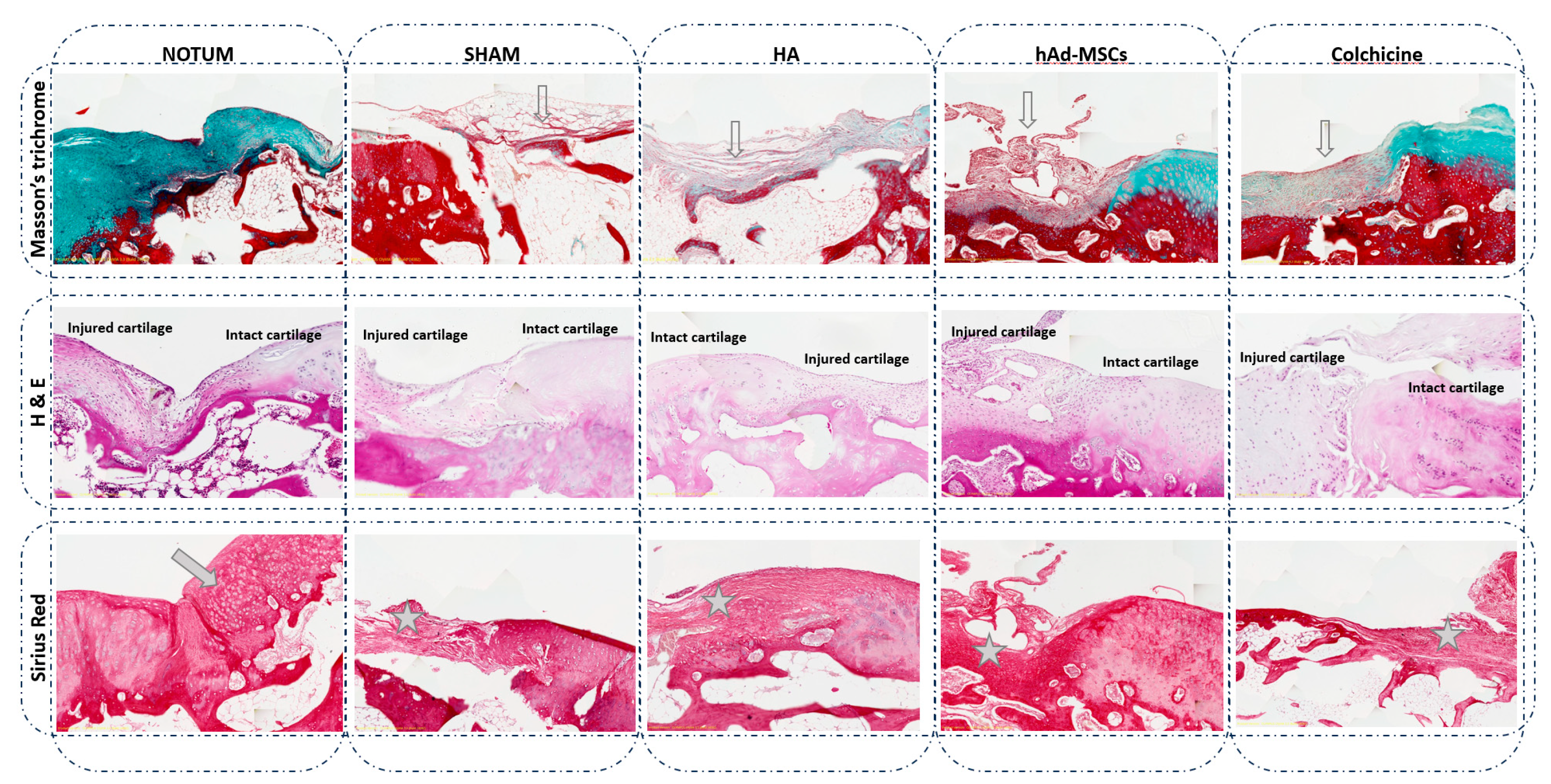 NOTUM Enhances Cartilage Repair via Wnt/β-Catenin Modulation in a ...