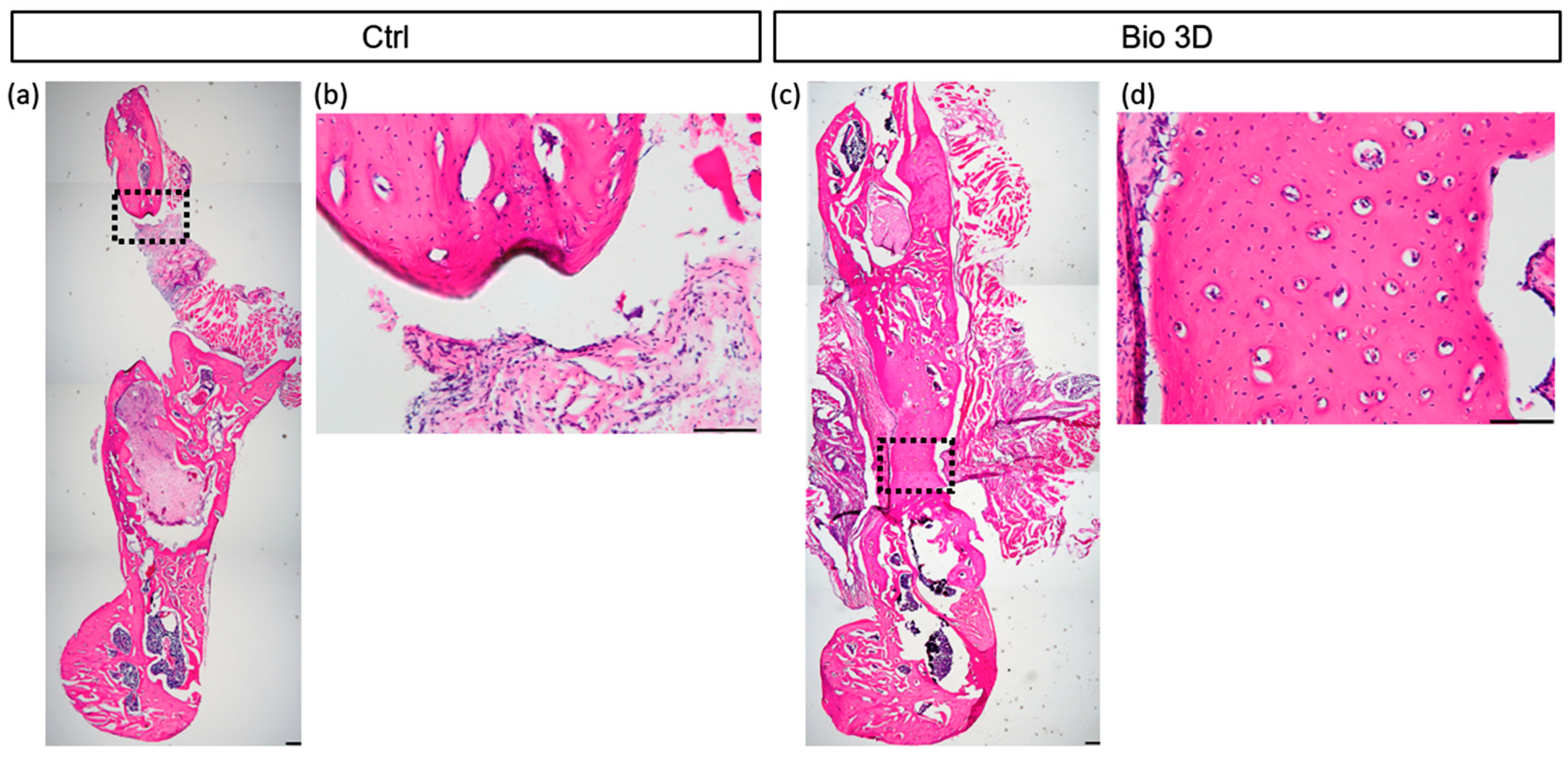 Enhanced Bone Regeneration by Scaffold-Free Three-Dimensional ...
