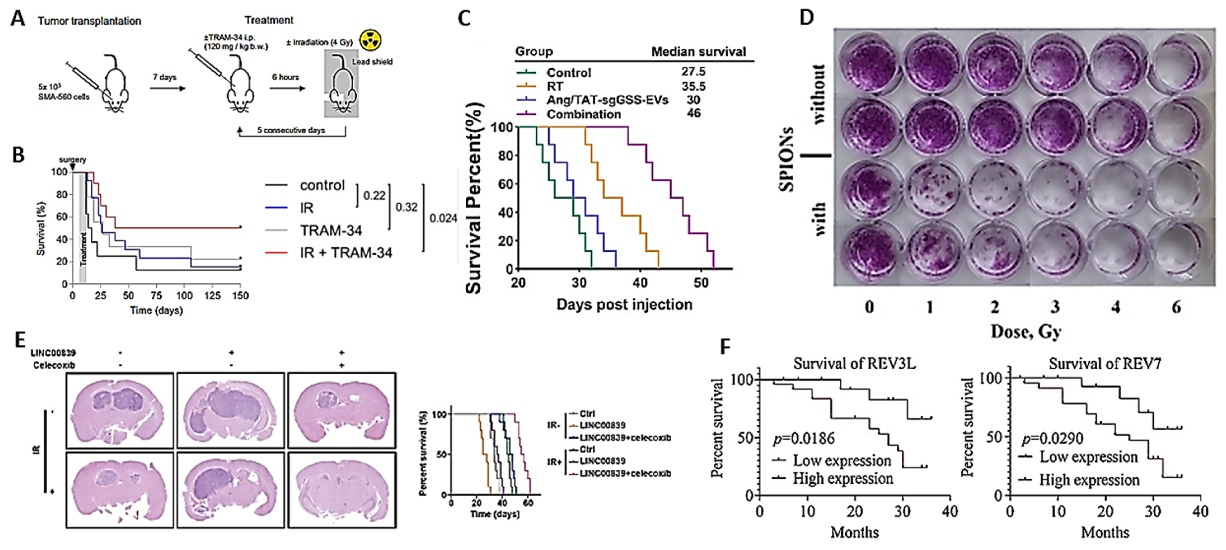 Radiotherapy for High-Grade Gliomas in Adults and Children: A ...