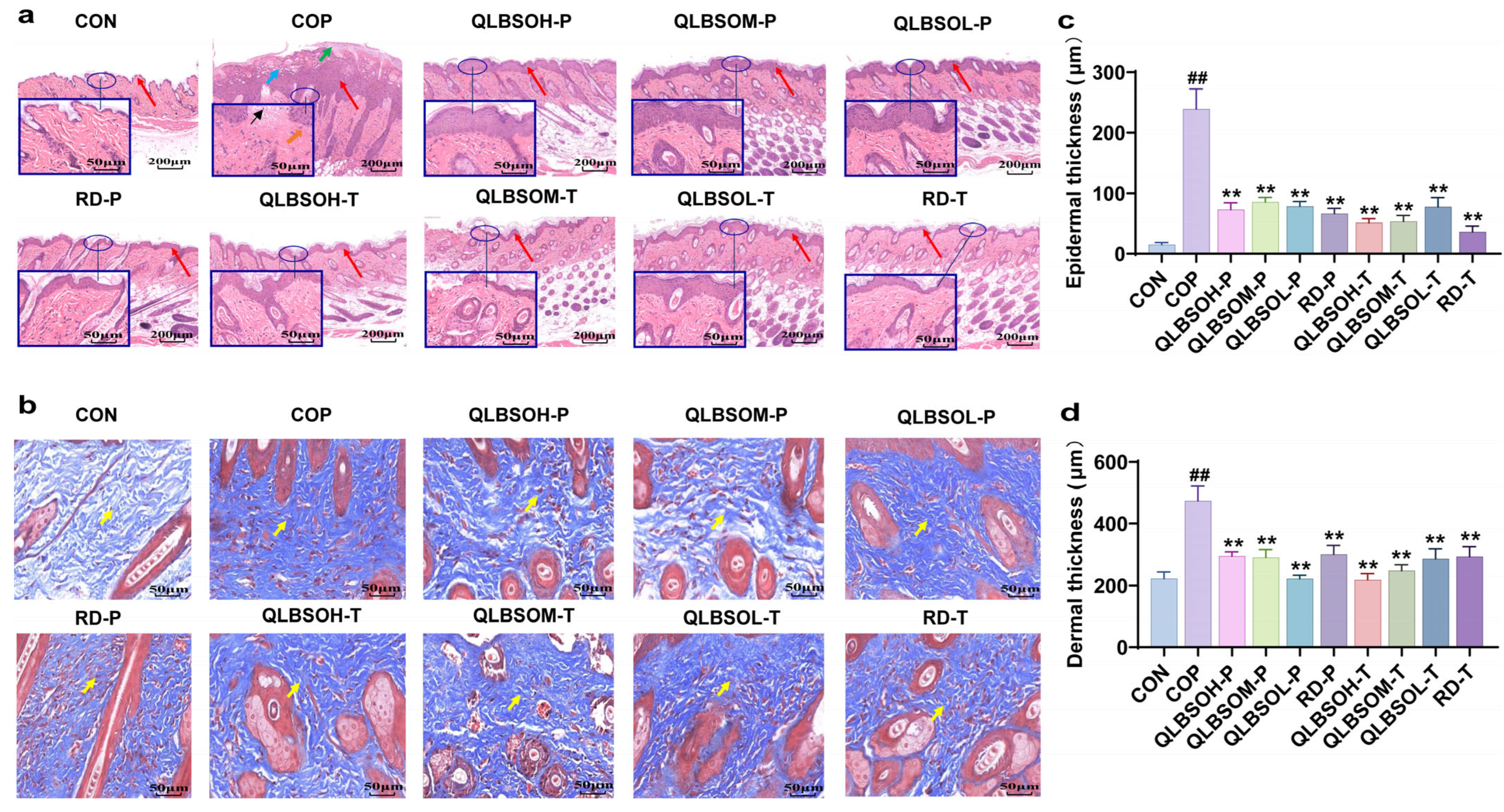 Seed Oil of Lycium barbarum L. from Qaidam Basin Prevents and Treats UV ...
