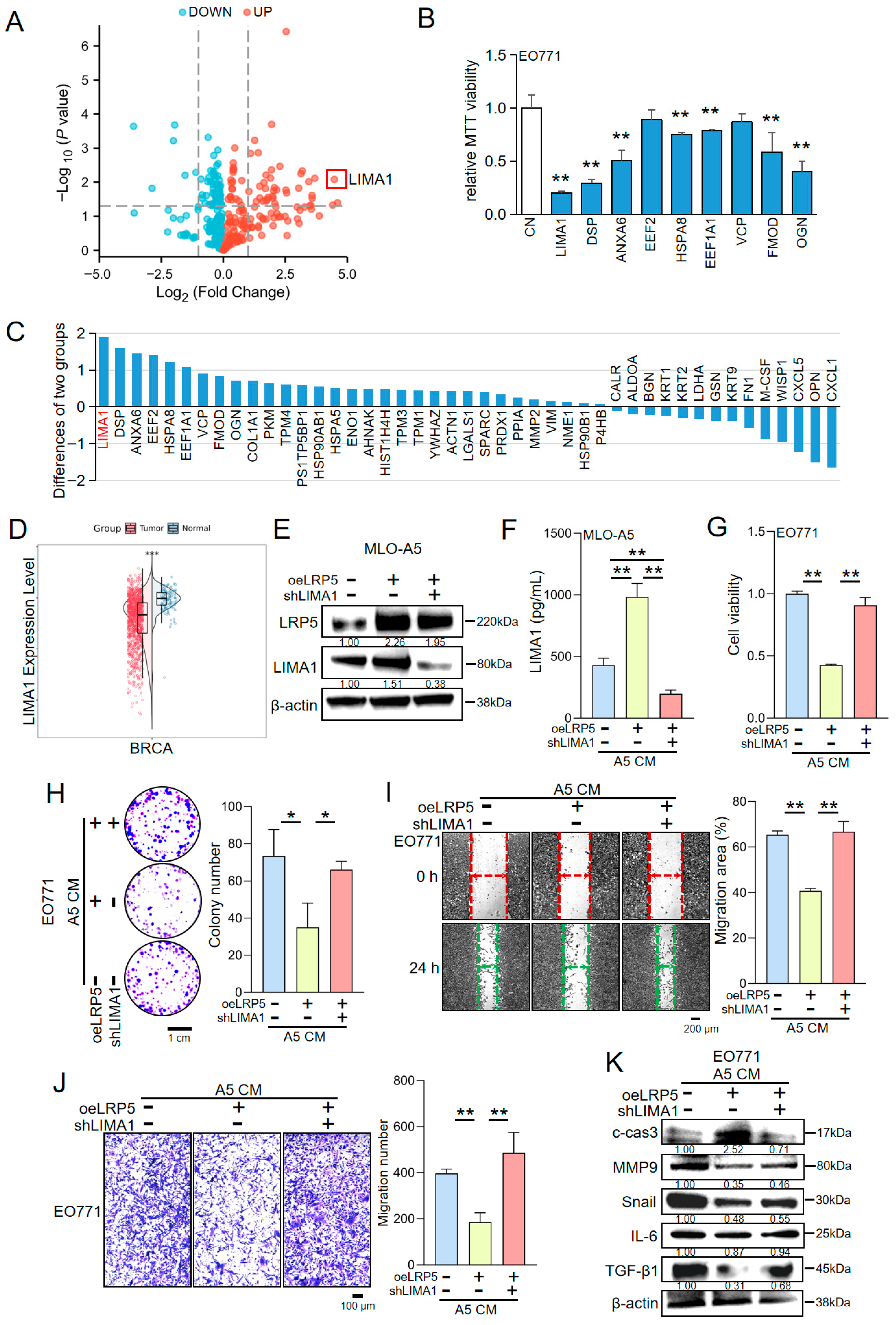 Inhibition of Breast Cancer Bone Metastasis by LRP5-Overexpressing ...