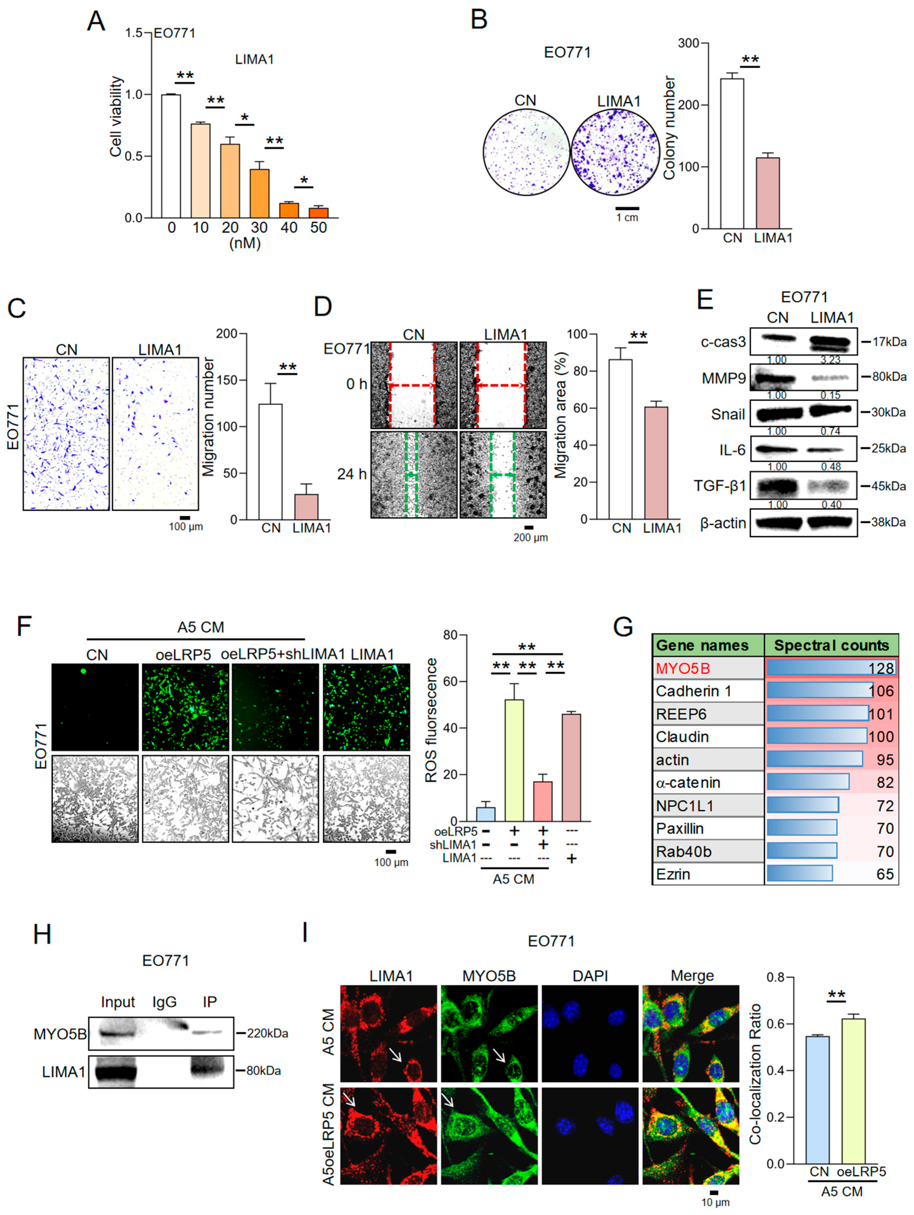Inhibition of Breast Cancer Bone Metastasis by LRP5-Overexpressing ...