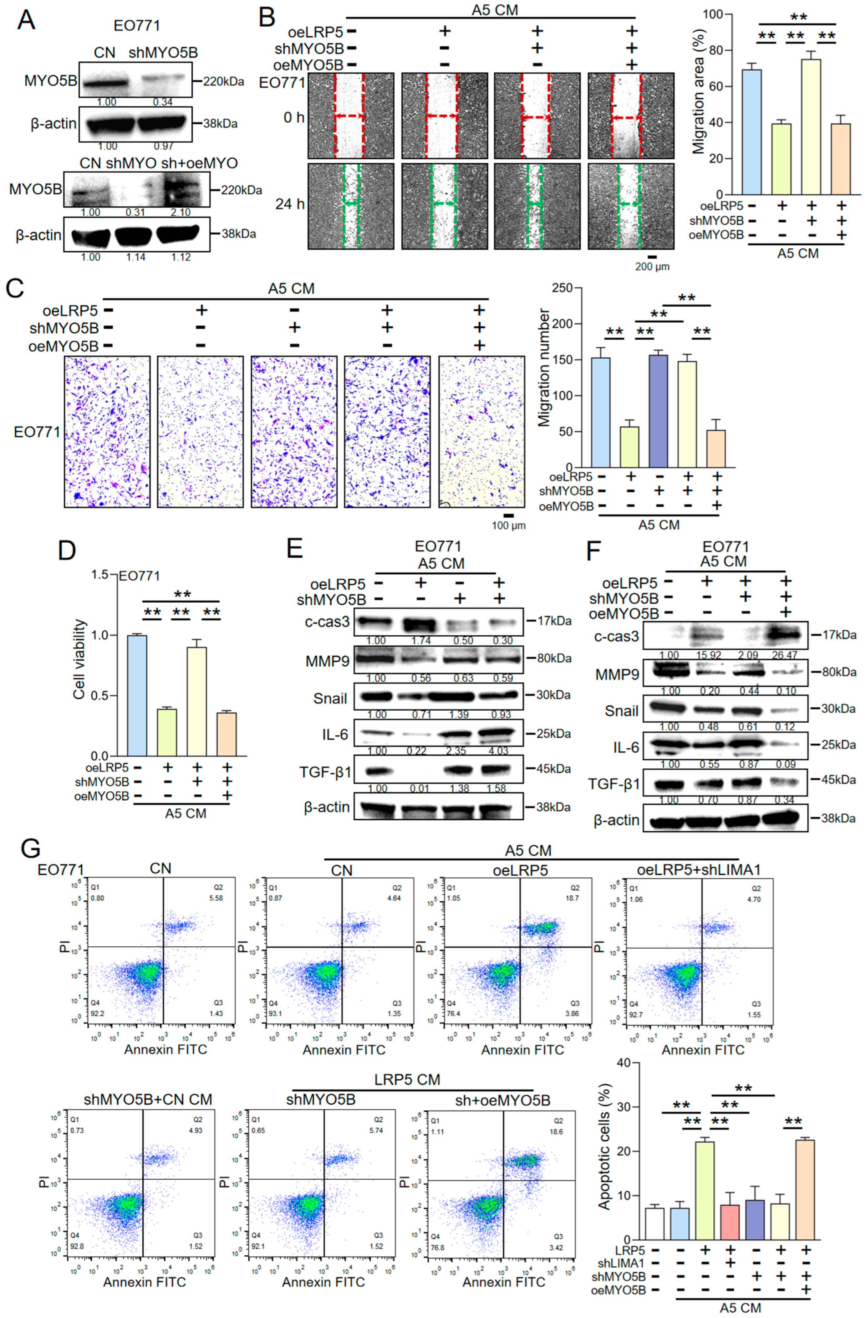 Inhibition of Breast Cancer Bone Metastasis by LRP5-Overexpressing ...