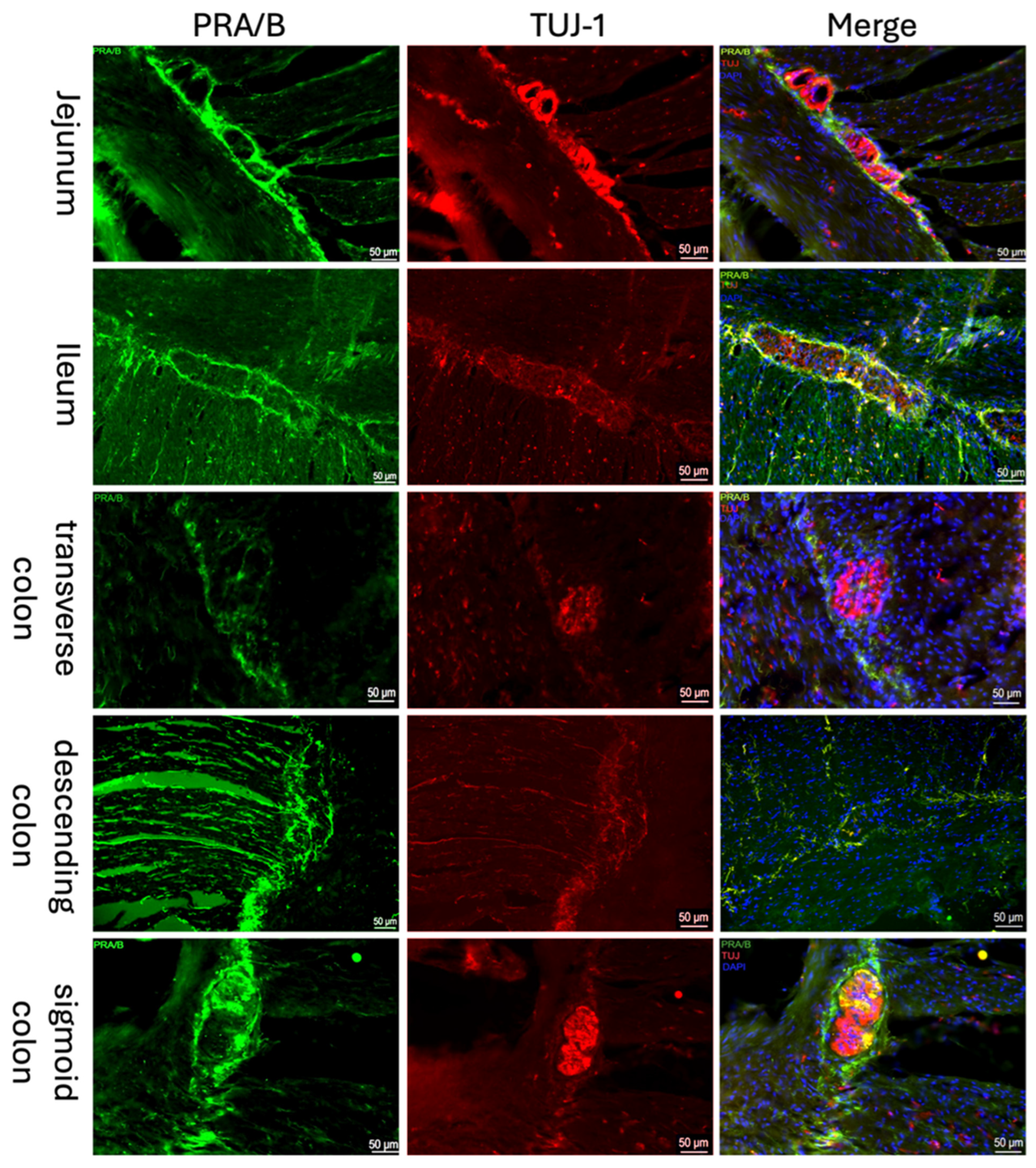 Progesterone Receptor Expression in the Human Enteric Nervous System