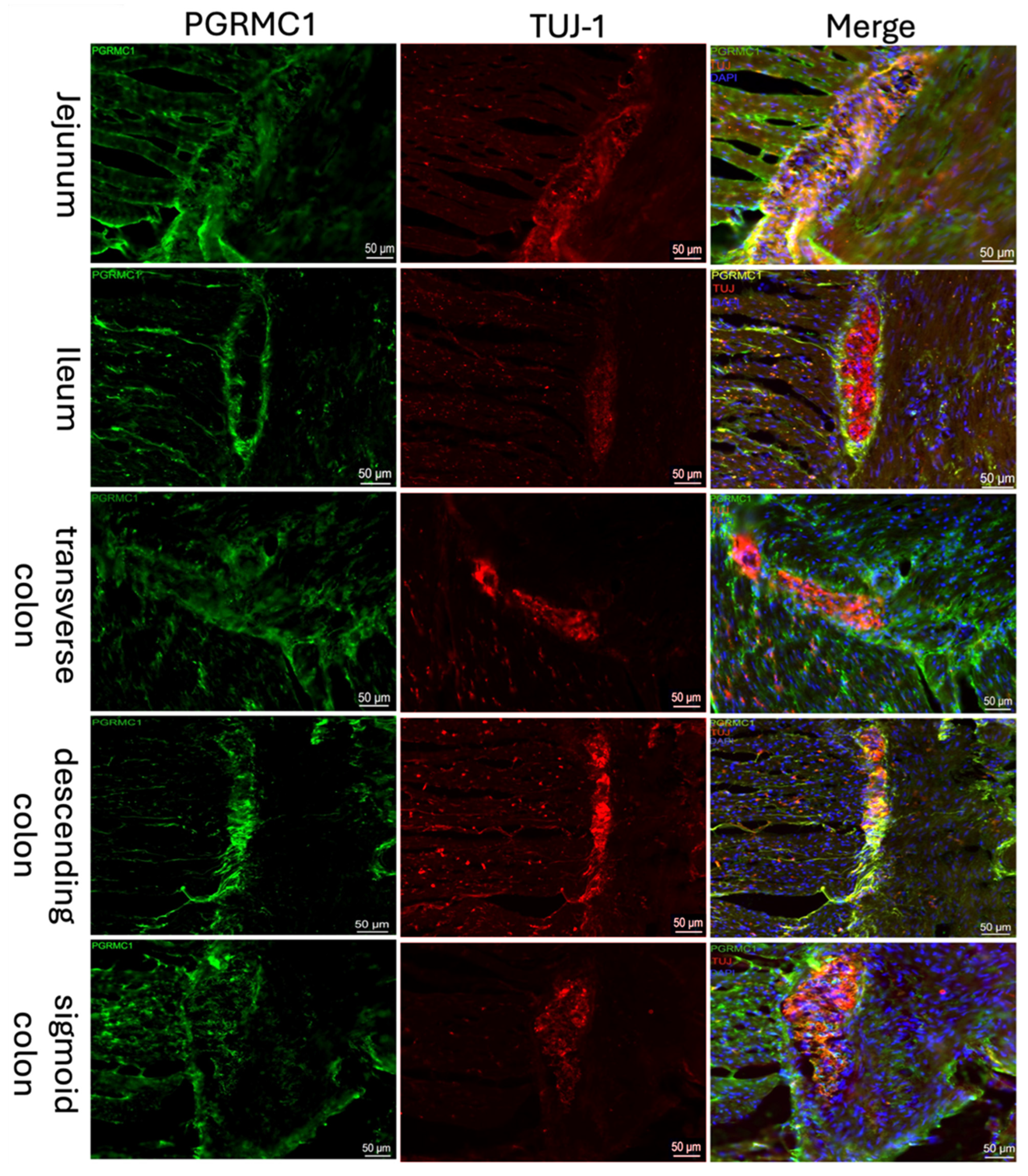 Progesterone Receptor Expression in the Human Enteric Nervous System