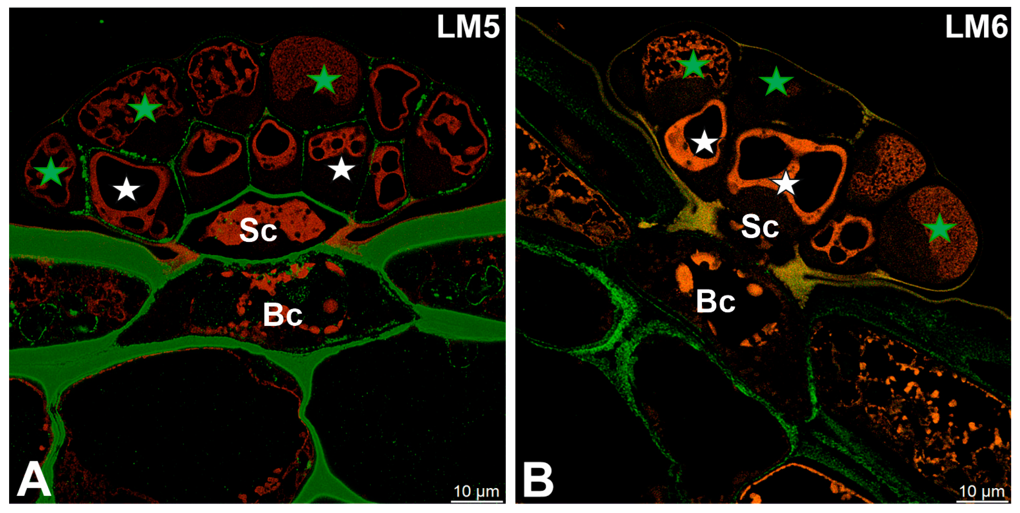 Immunocytochemical Analysis of the Wall Ingrowths and Cell Wall ...