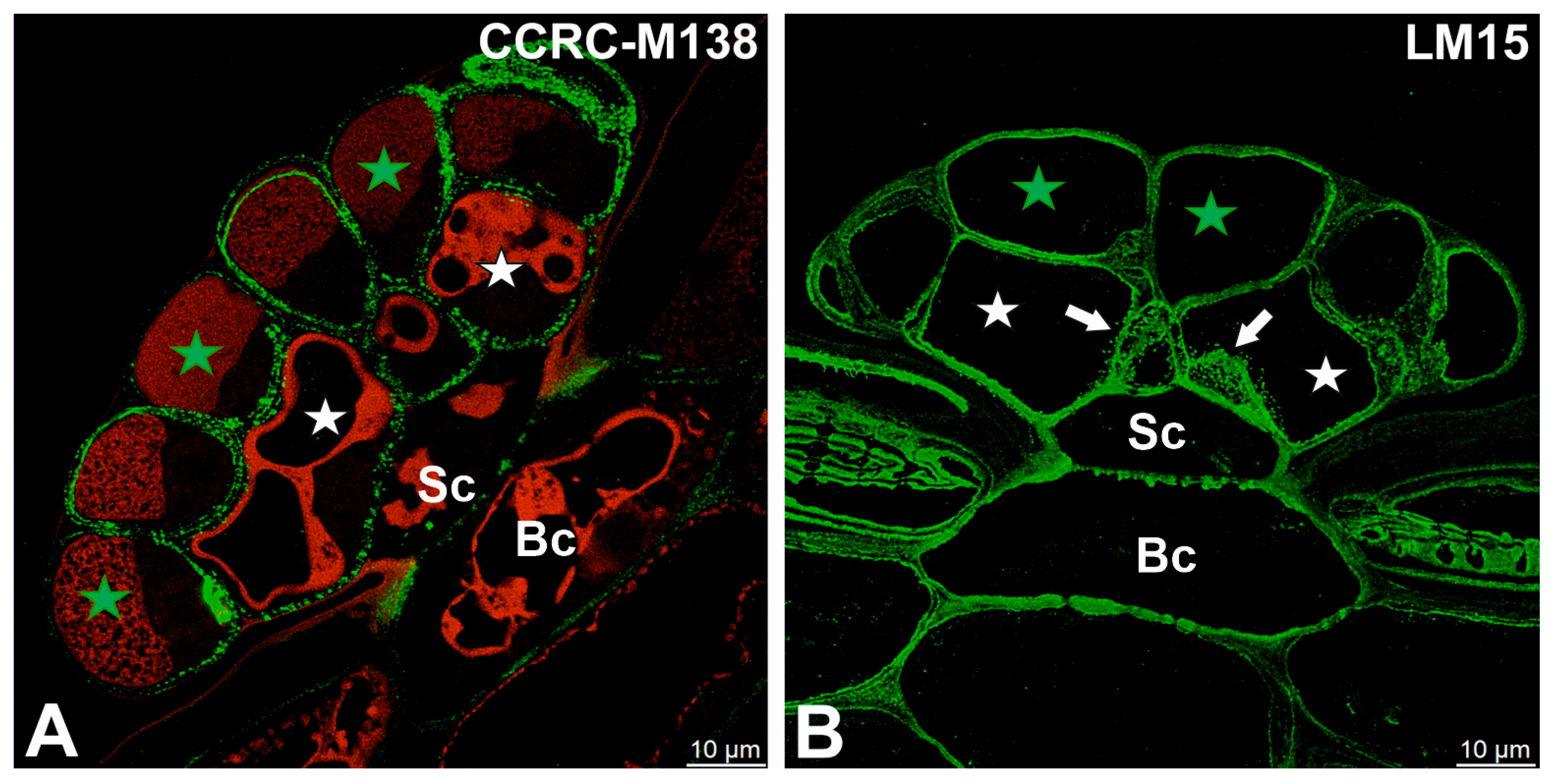 Immunocytochemical Analysis of the Wall Ingrowths and Cell Wall ...