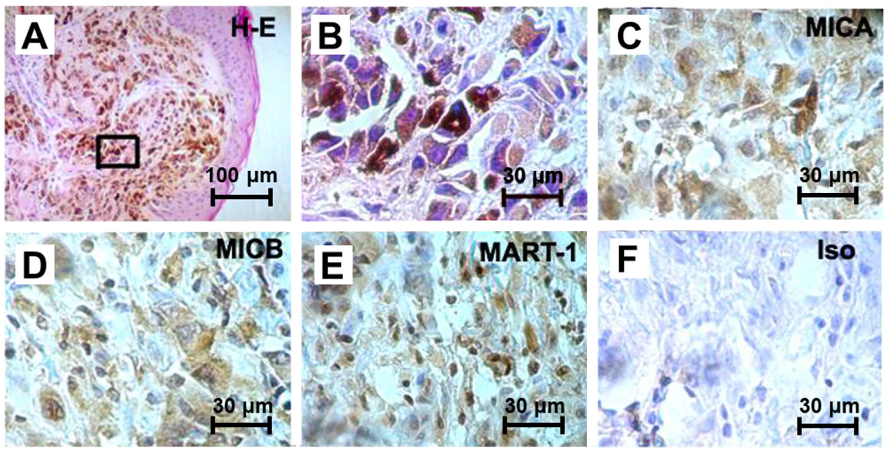 Calreticulin-Mediated Quality Control of the Non-Classical MHC-I ...